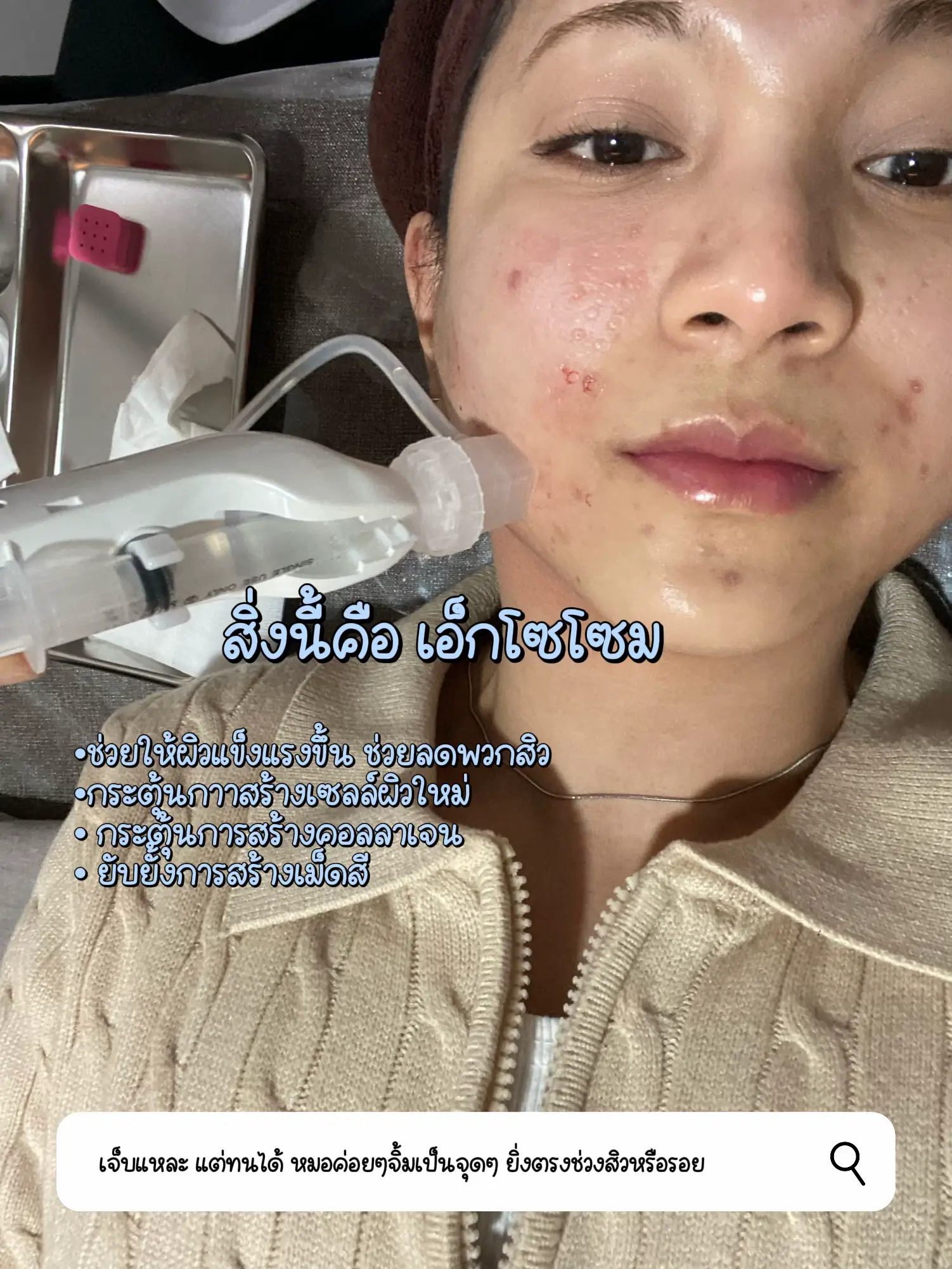 จิ้มหน้ารับปีใหม่ 🇰🇷รอบนี้ลอง VANDSCLINIC | แกลเลอรีที่โพสต์โดย เยริมิเยม• | Lemon8