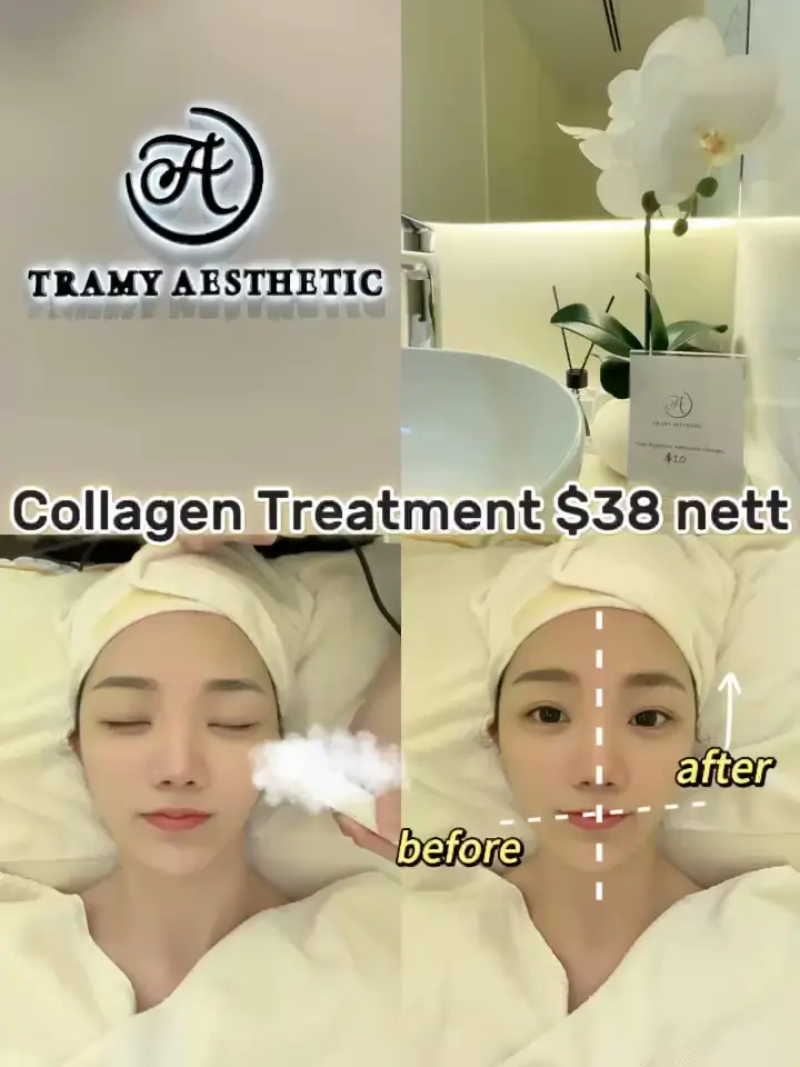 Collagen treatment - Relaxing | Video published by Tramy Aesthetic | Lemon8