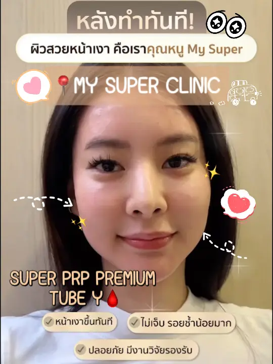 🌟 Perfect Skin ด้วย Super Prp premium “Tube Y” 🥰 | วิดีโอที่เผยแพร่โดย mysuperclinic | Lemon8