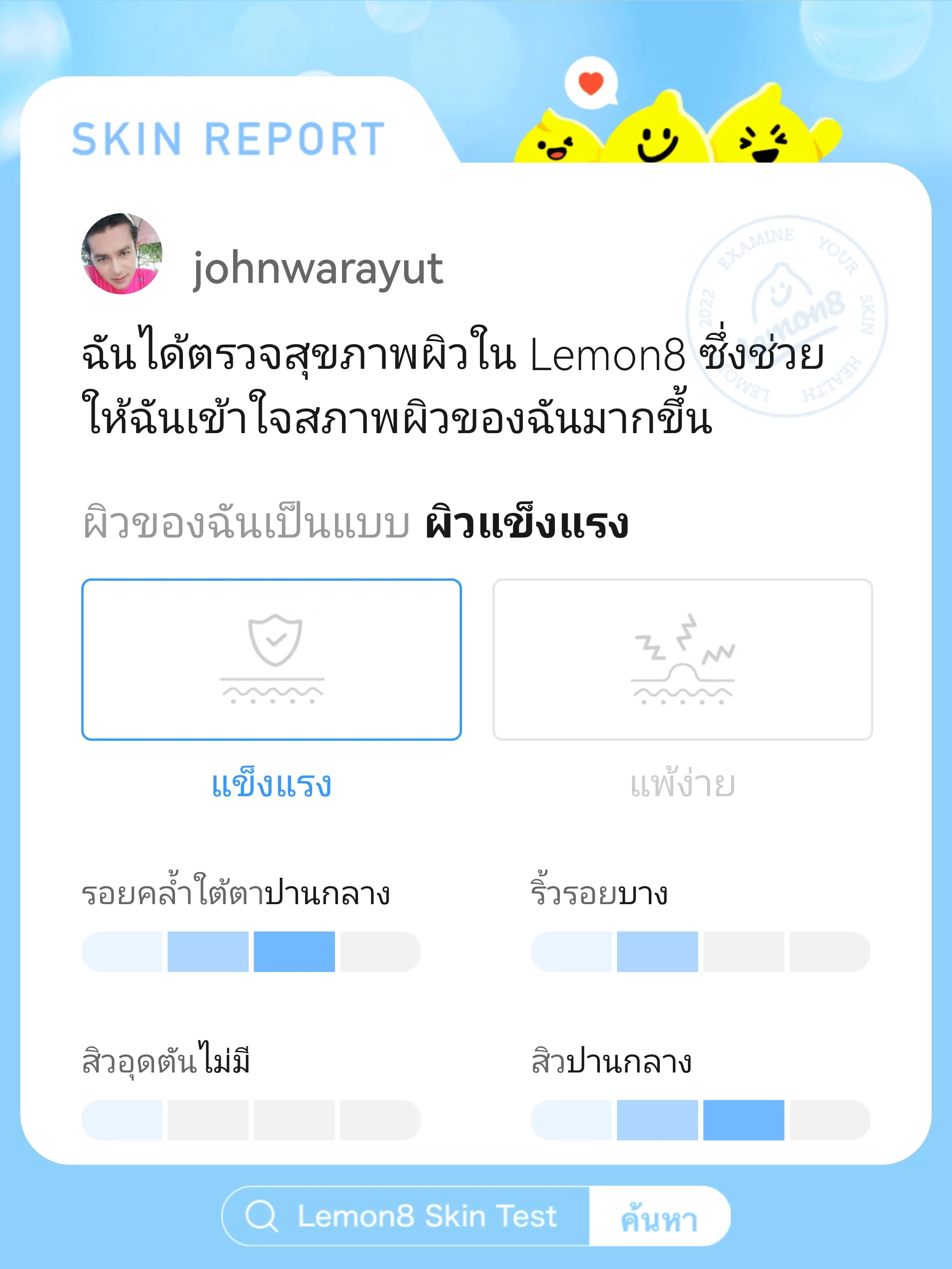 รายงานสภาพผิวของฉัน | แกลเลอรีที่โพสต์โดย John Warayut | Lemon8