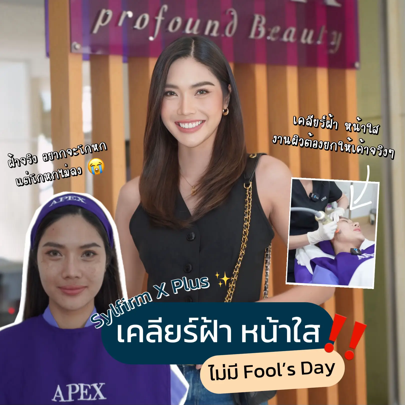 Sylfirm X Plus Clear Frosted Face No Fool's Day 🥳 | Gallery posted by APEX BEAUTY | Lemon8