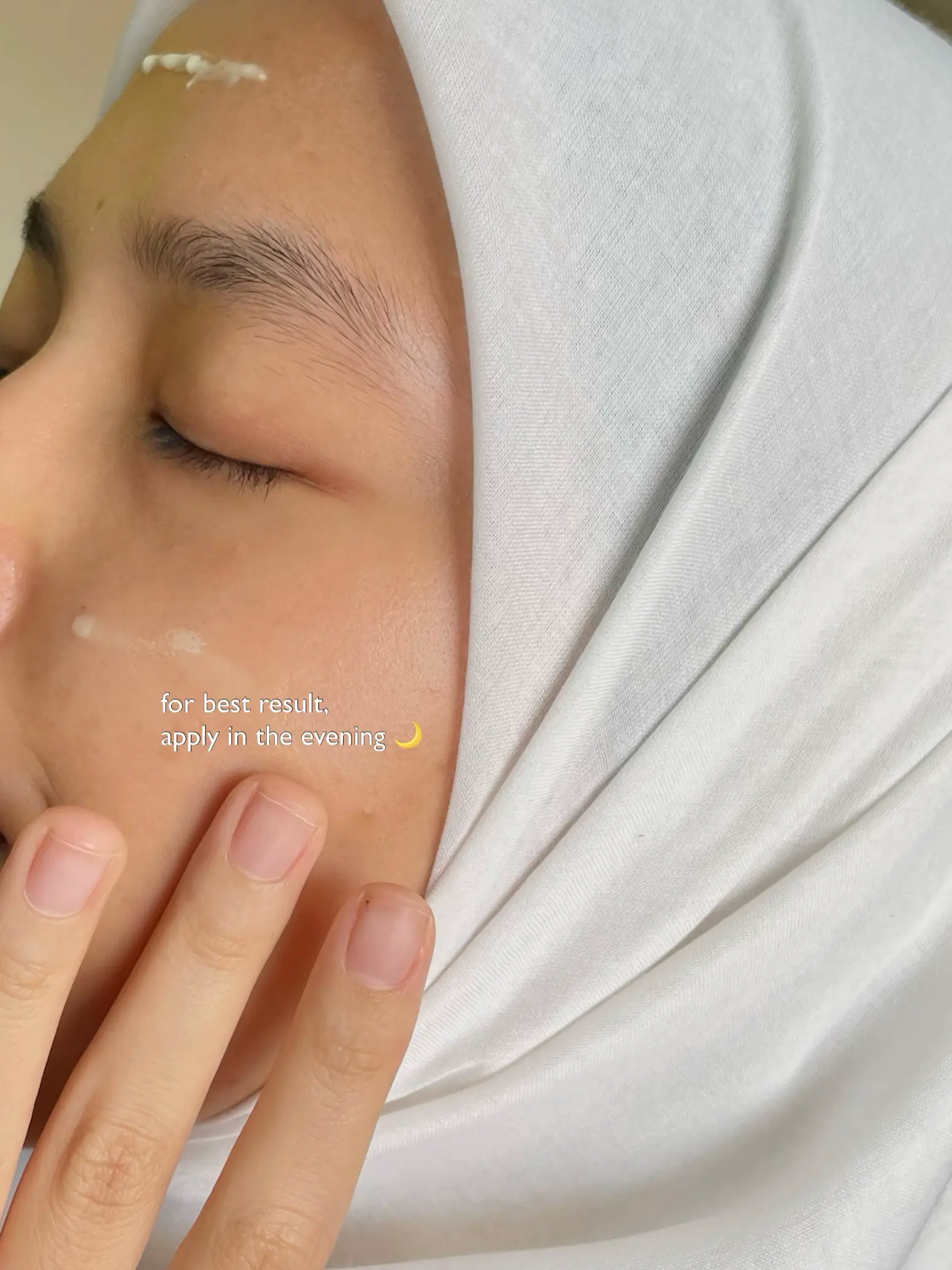 Acne Marks ?? Bye bye 😘 | แกลเลอรีที่โพสต์โดย anis | Lemon8