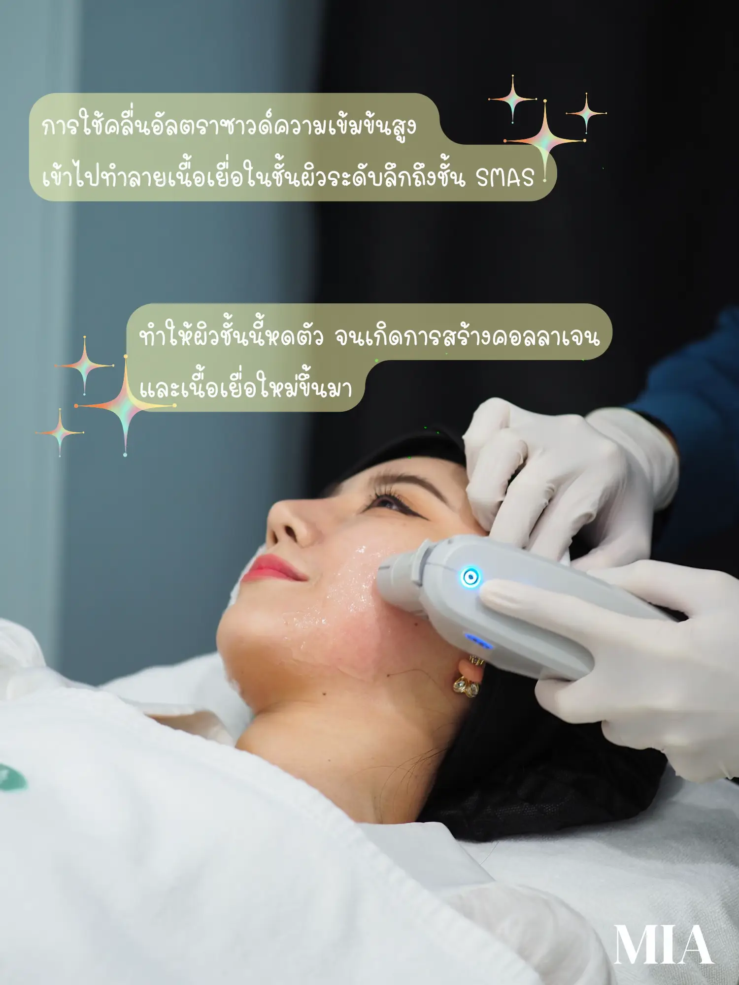 🌷การทำงานของ HIFU🌷 | แกลเลอรีที่โพสต์โดย MIA รีวิว | Lemon8