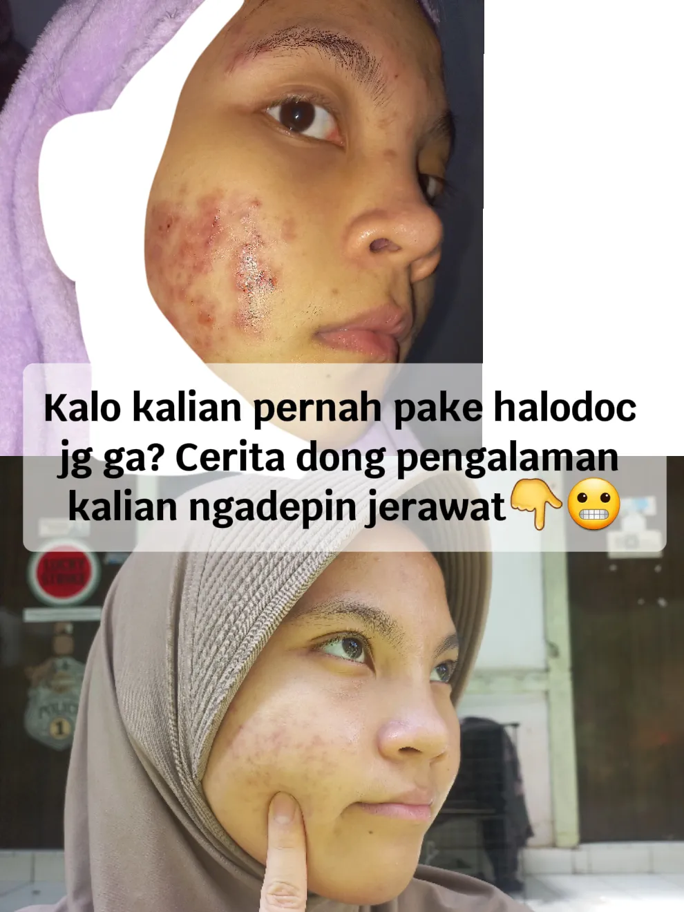 ANDAI AKU PAKE HALODOC DARI DULU‼️😭 | Galeri diposting oleh Zka★☆ | Lemon8