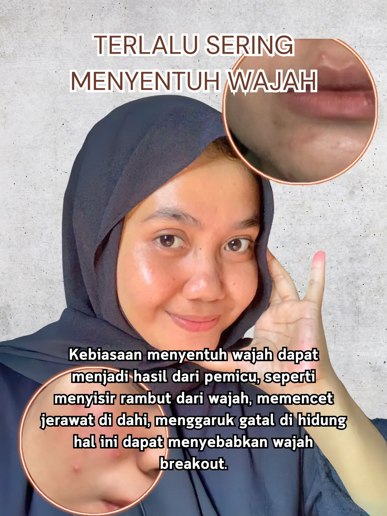 Tantangan 2024 Kulit Sehat Cewek Wajib Tau | Galeri diposting oleh 𝒩𝒾𝓇 | Lemon8