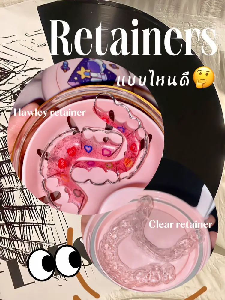 Retainers ลวดหรือใส?🤔 | แกลเลอรีที่โพสต์โดย lilGi🎈 | Lemon8