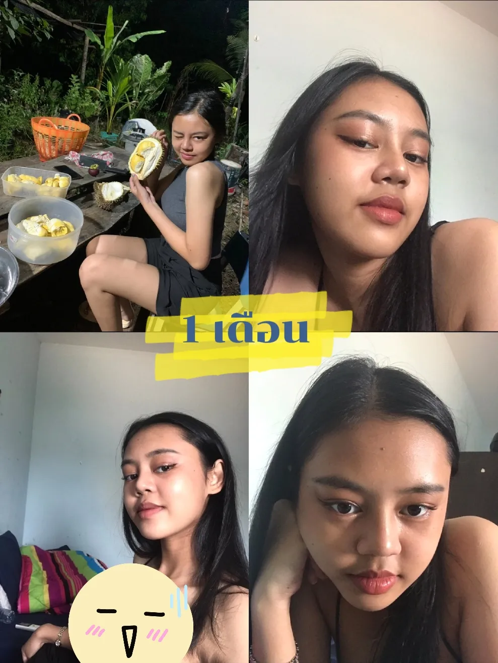 อายุ16ทำจมูก? | แกลเลอรีที่โพสต์โดย ซีด๋อย | Lemon8