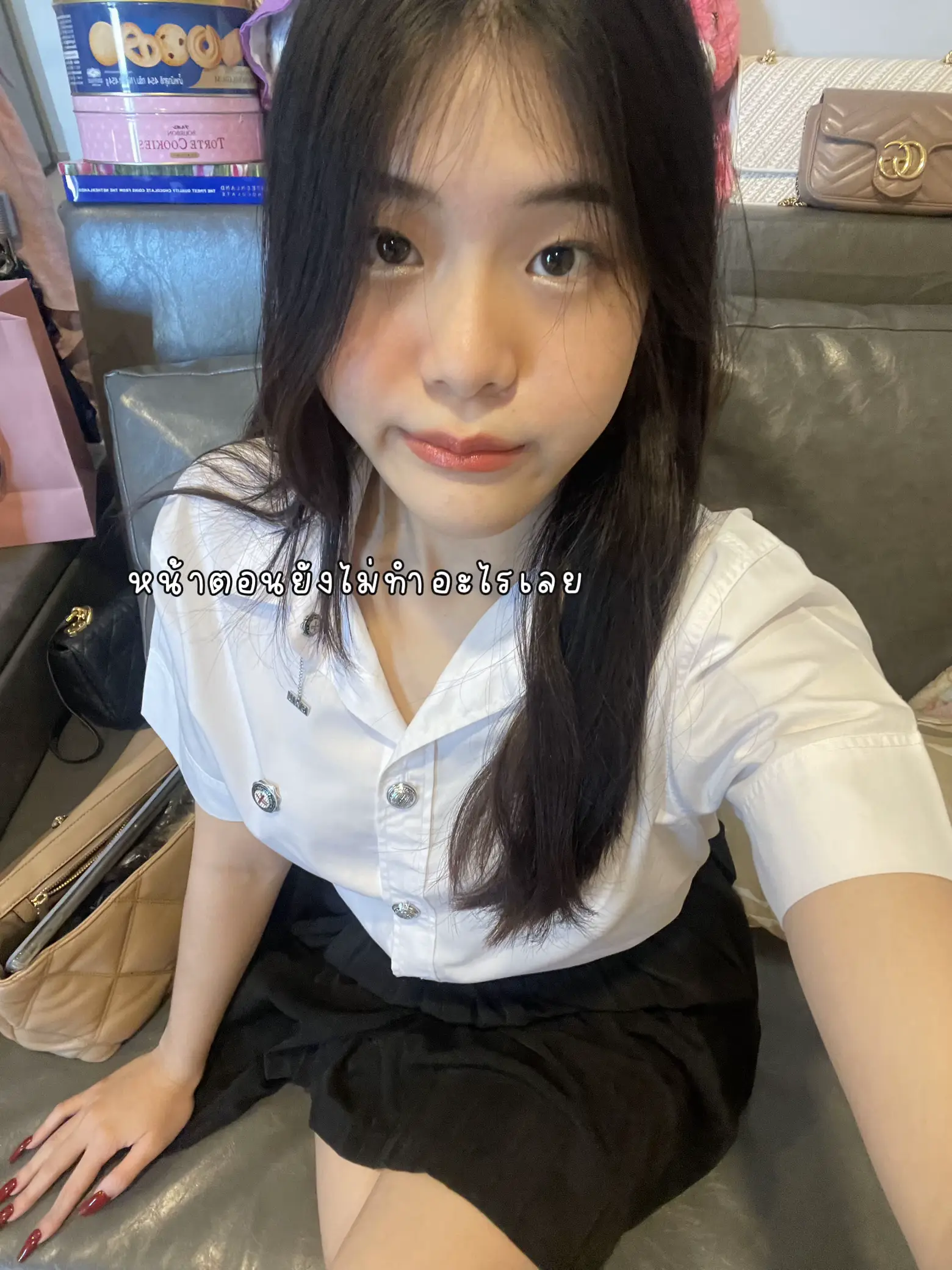 รีวิวศัลยกรรม ภายใน 1 ปี!! ทำอะไรมาบ้าง⭐️🎀 | แกลเลอรีที่โพสต์โดย tinyy☃️ | Lemon8