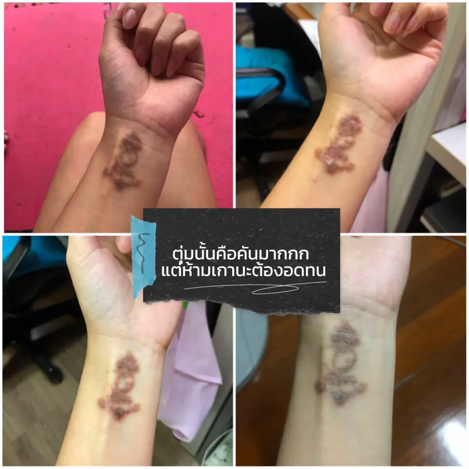 รีวิวกังนัมคลินิกสาขา Ics - การค้นหาใน Lemon8