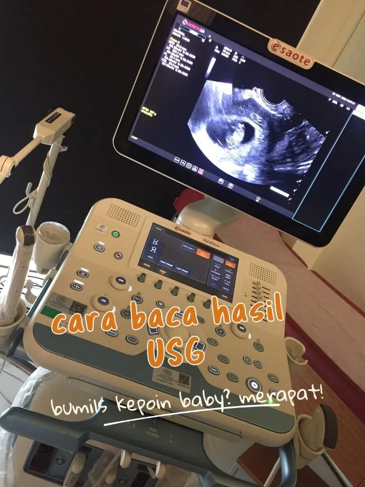 cara baca hasil USG, anti bingung! | Galeri diposting oleh ...