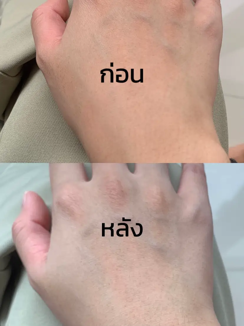 สูตรนี้ 1 เดือนขาวขึ้นจนเพื่อนทัก📌 | แกลเลอรีที่โพสต์โดย aaon_11 | Lemon8