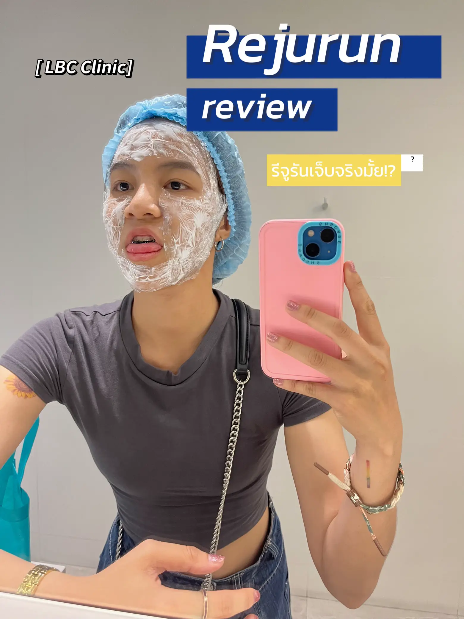 ฉีดรีจูรัน เจ็บไหม ดีจริงไหม ?🧐💉 | แกลเลอรีที่โพสต์โดย kamon | Lemon8