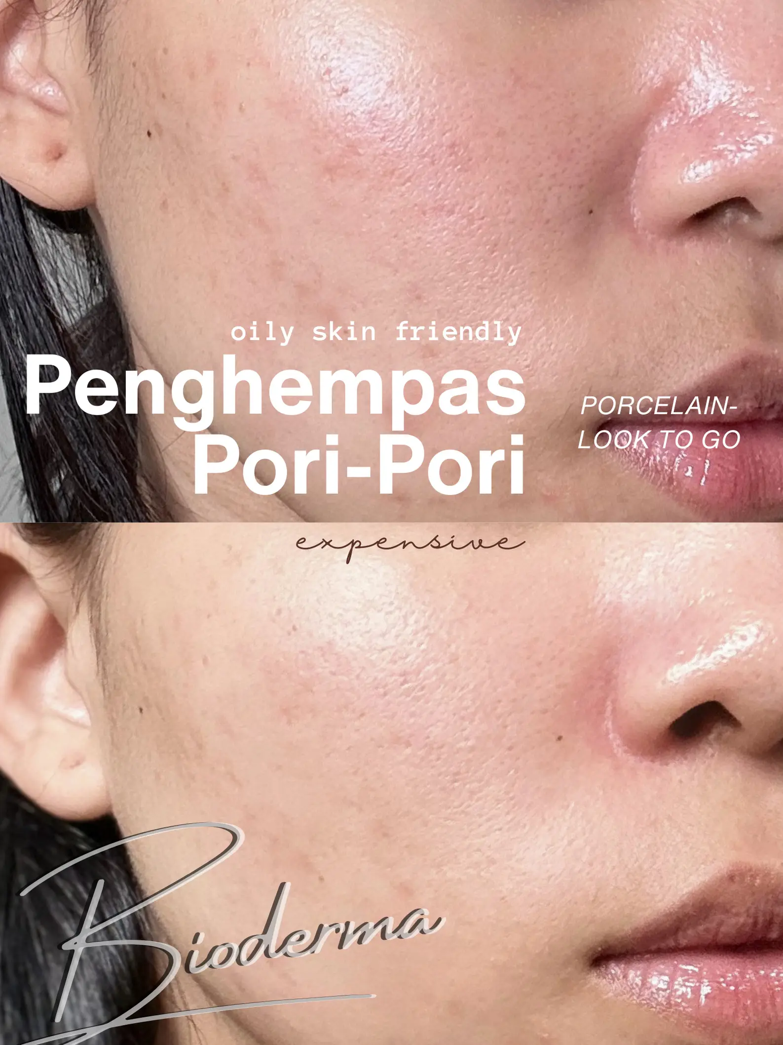 AVATAR - OIL CONTROL AND PORE BLOCKAGE 🧜🏻‍♀️ | Galeri diposting oleh ...