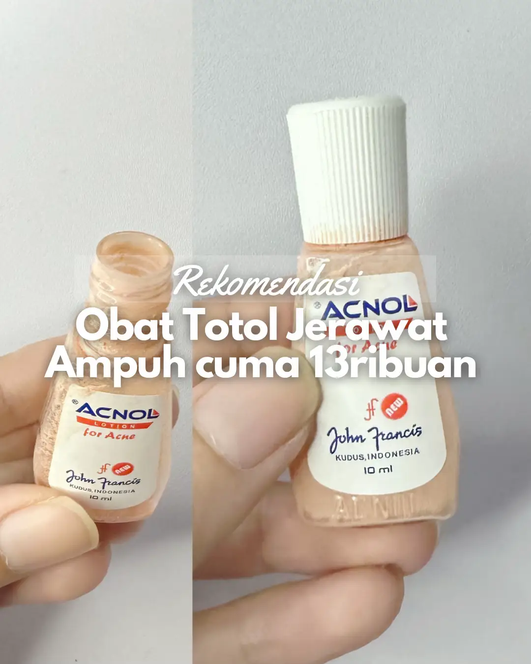 Obat Totol Jerawat Cuma 13ribuan | Auto Kempes | Galeri diposting oleh ...