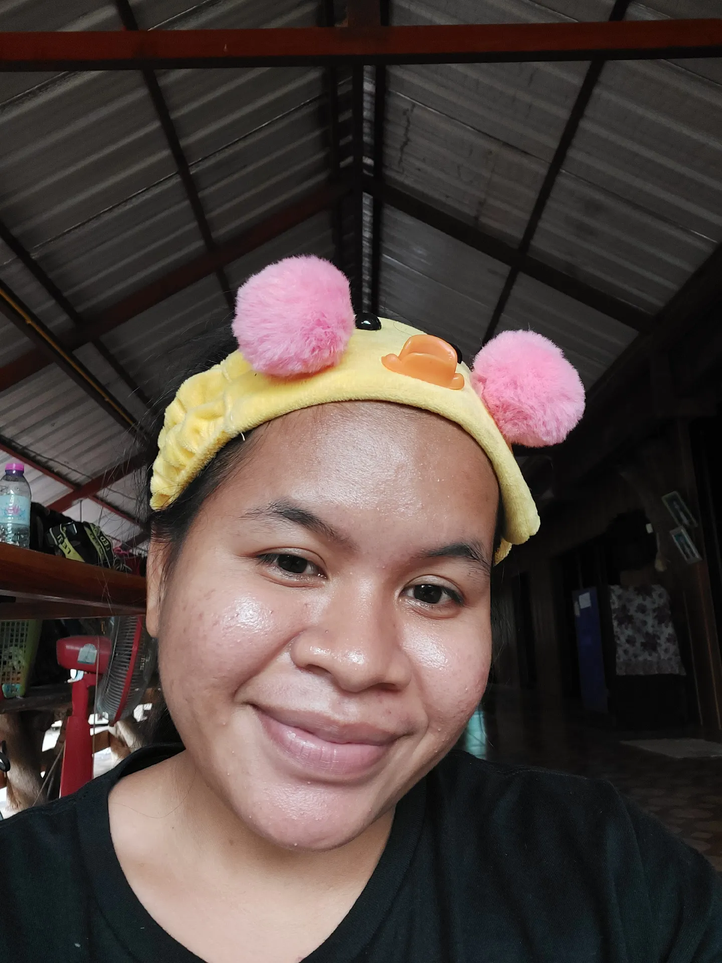 รักษาสิวด้วยตัวเองทำอะไรบ้าง ️ | แกลเลอรีที่โพสต์โดย Chanakan. | Lemon8