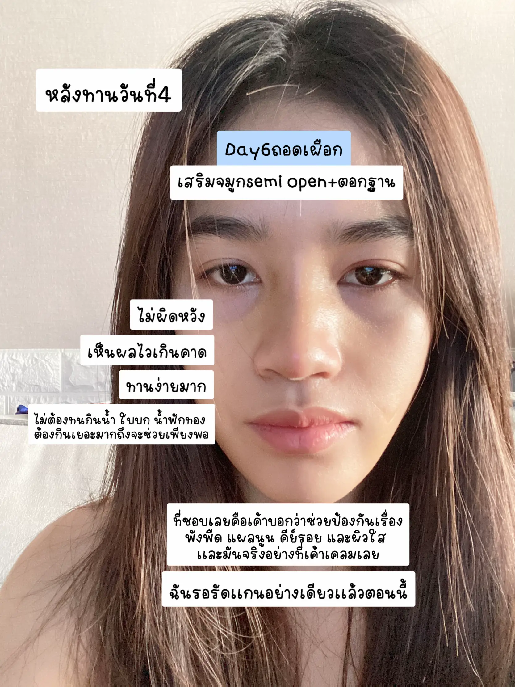 ลดบวม Proctase-P คือ ยา แก้ อะไร - การค้นหาใน Lemon8