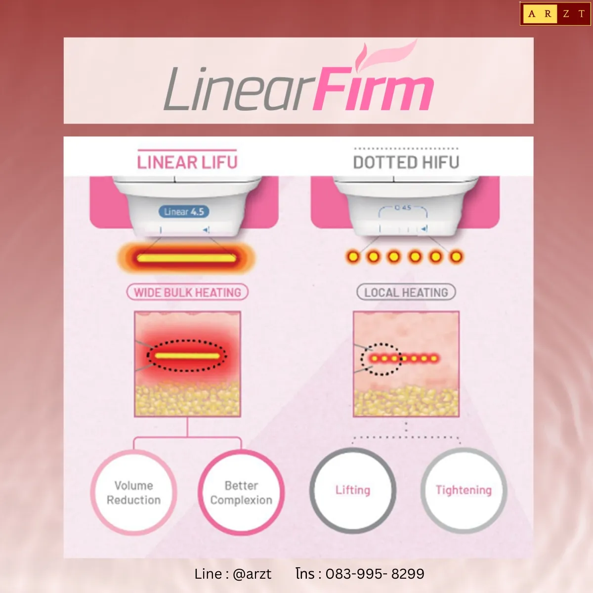 Linear HIFU ใช้ลดไขมัน และยกกระชับได้จริงหรือ? | แกลเลอรีที่โพสต์โดย Arzt clinic | Lemon8