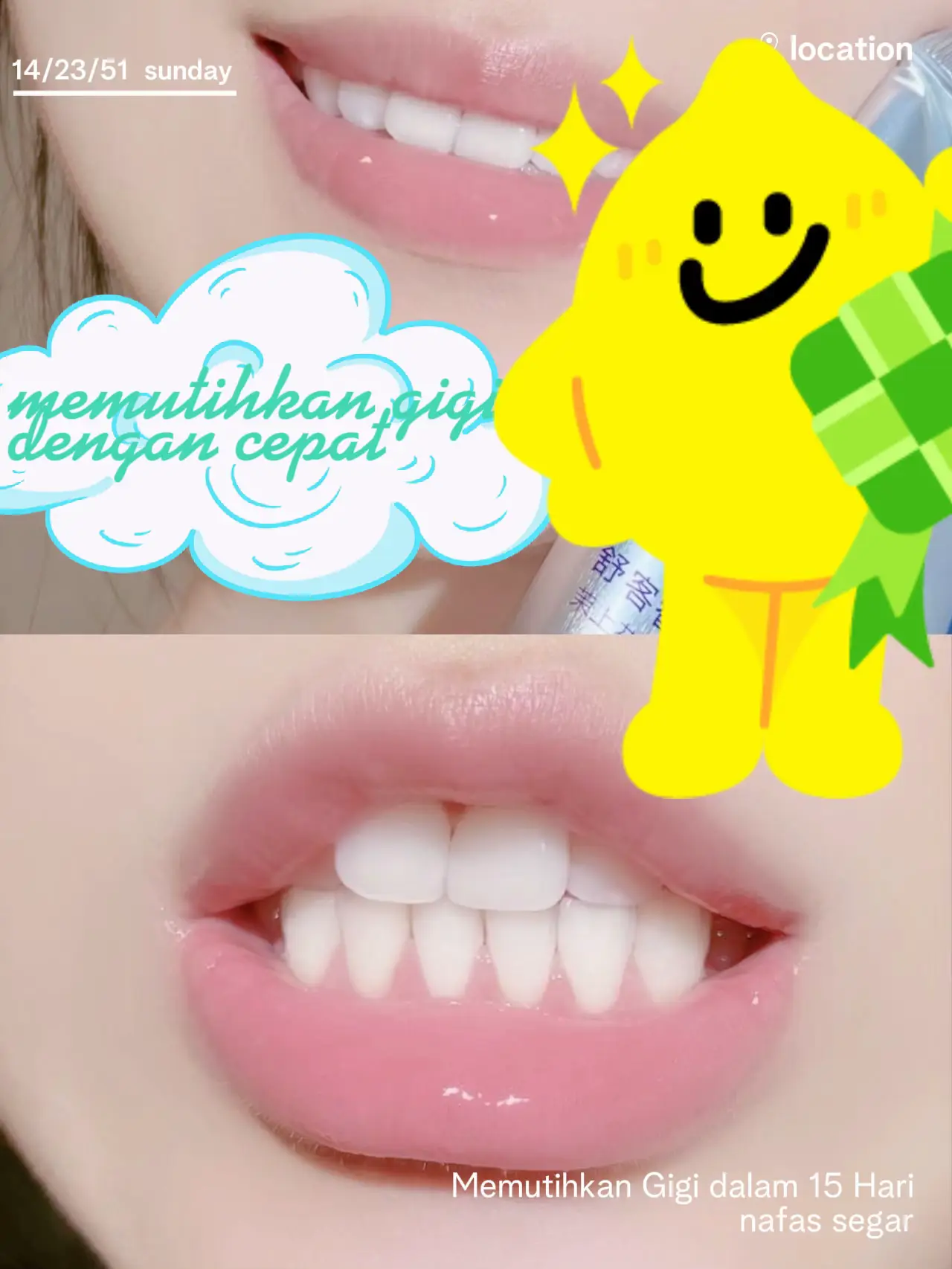 memutihkan gigi dengan cepat | Galeri disiarkan oleh cantik·a | Lemon8