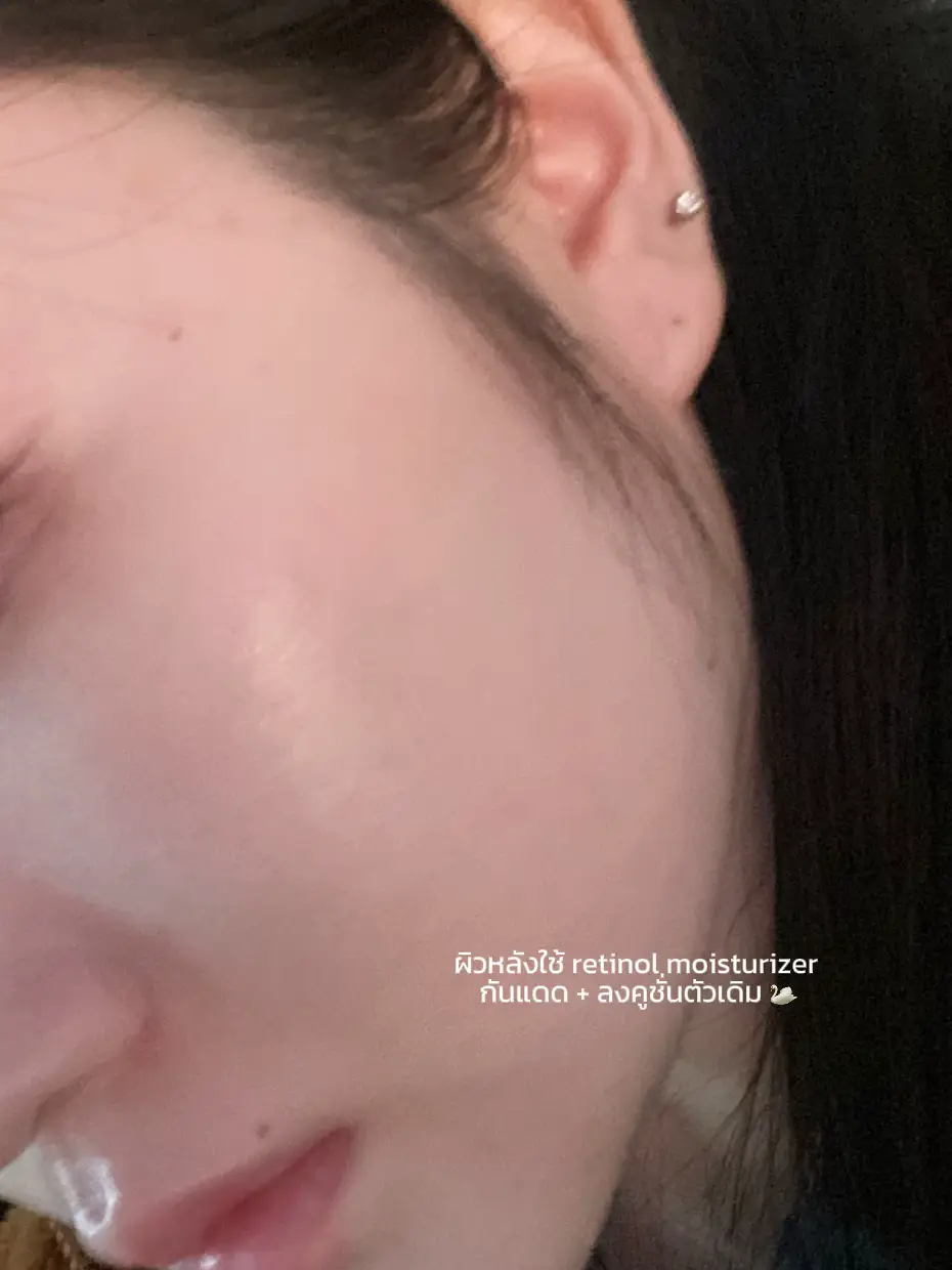 รีวิว glad2glow retinol moisturizer (ver.ถูกและดี2025) | แกลเลอรีที่โพสต์โดย Darin ౨ৎ | Lemon8