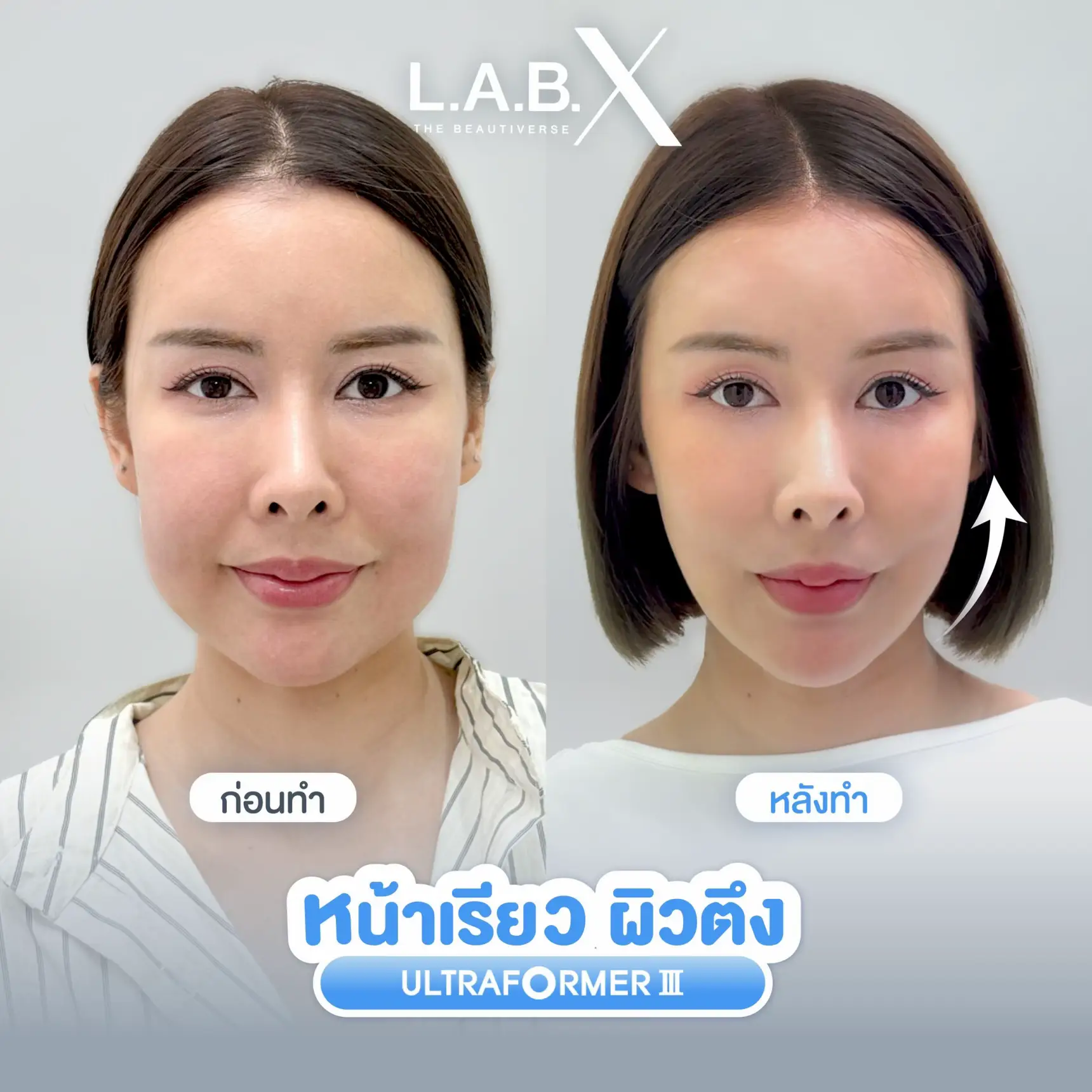 Open the slender face tips that celebrities secretly do! | Gallery ...