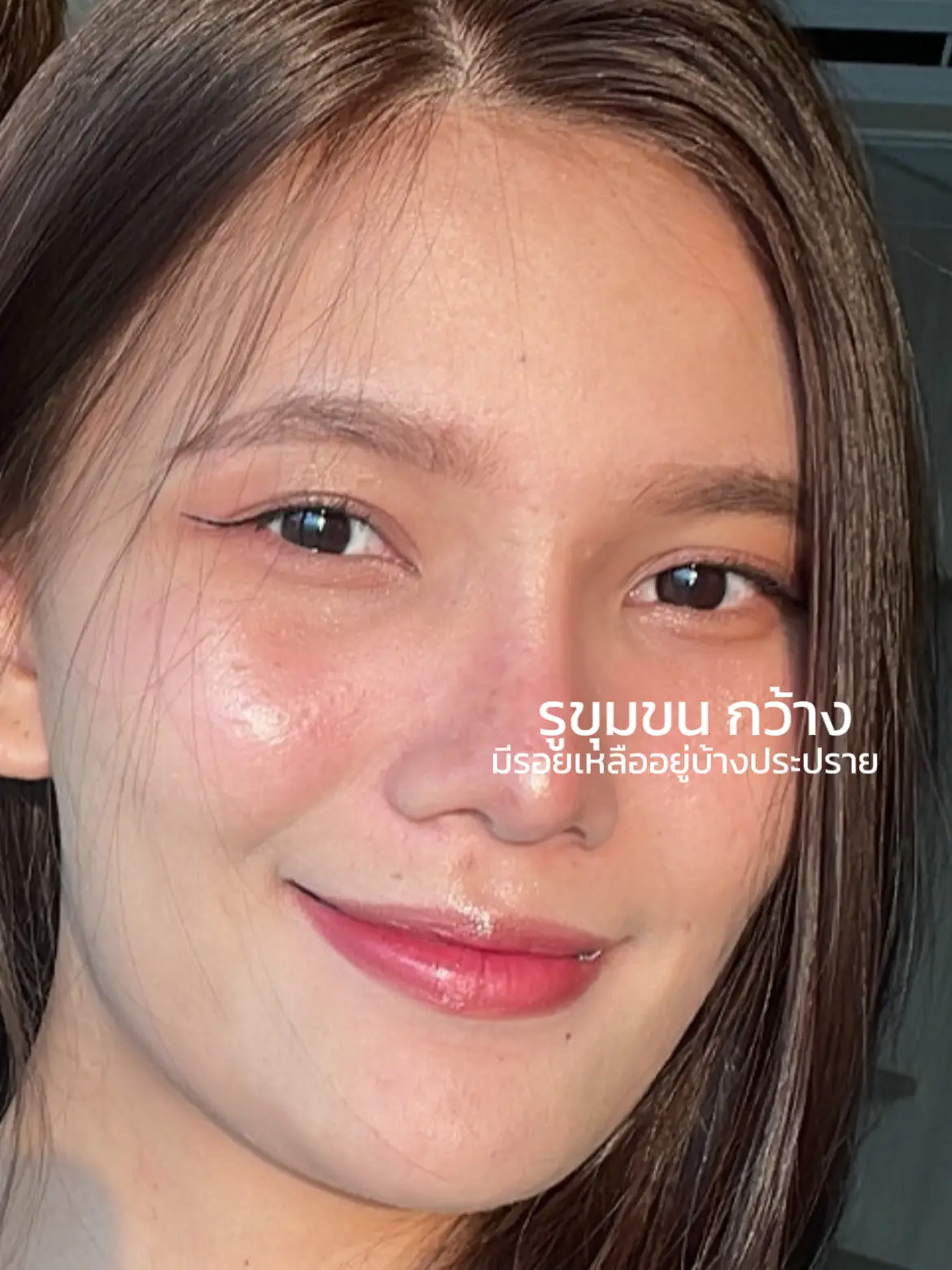 สกินแคร์ตัวเดียวก็ปังได้ แค่หน้าแข็งแรงจบทุกปัญหาผิว !🪞 | แกลเลอรีที่โพสต์โดย suppakan | Lemon8