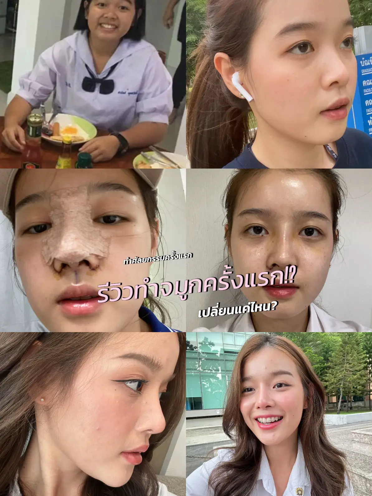 เปลี่ยนแค่ไหน? | แกลเลอรีที่โพสต์โดย Nim.S | Lemon8