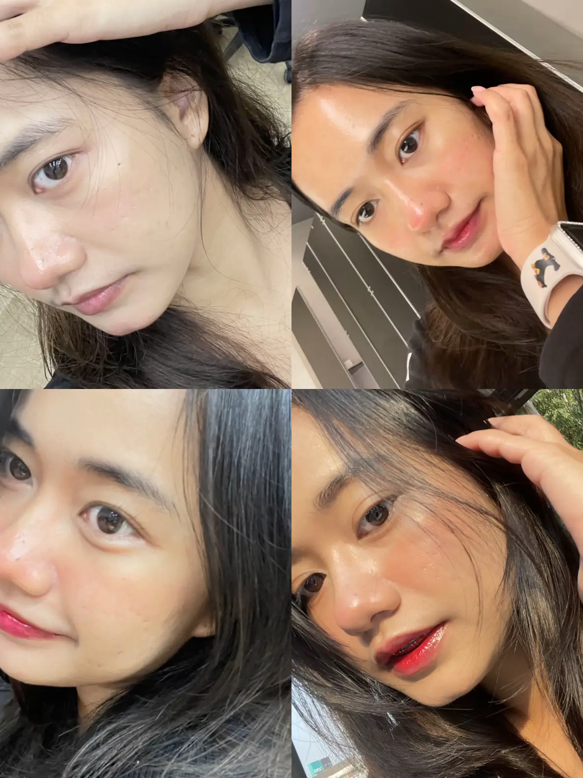 ประสบการณ์หลุดออกจากวงจรสิว !! | แกลเลอรีที่โพสต์โดย Maprang Chaya | Lemon8