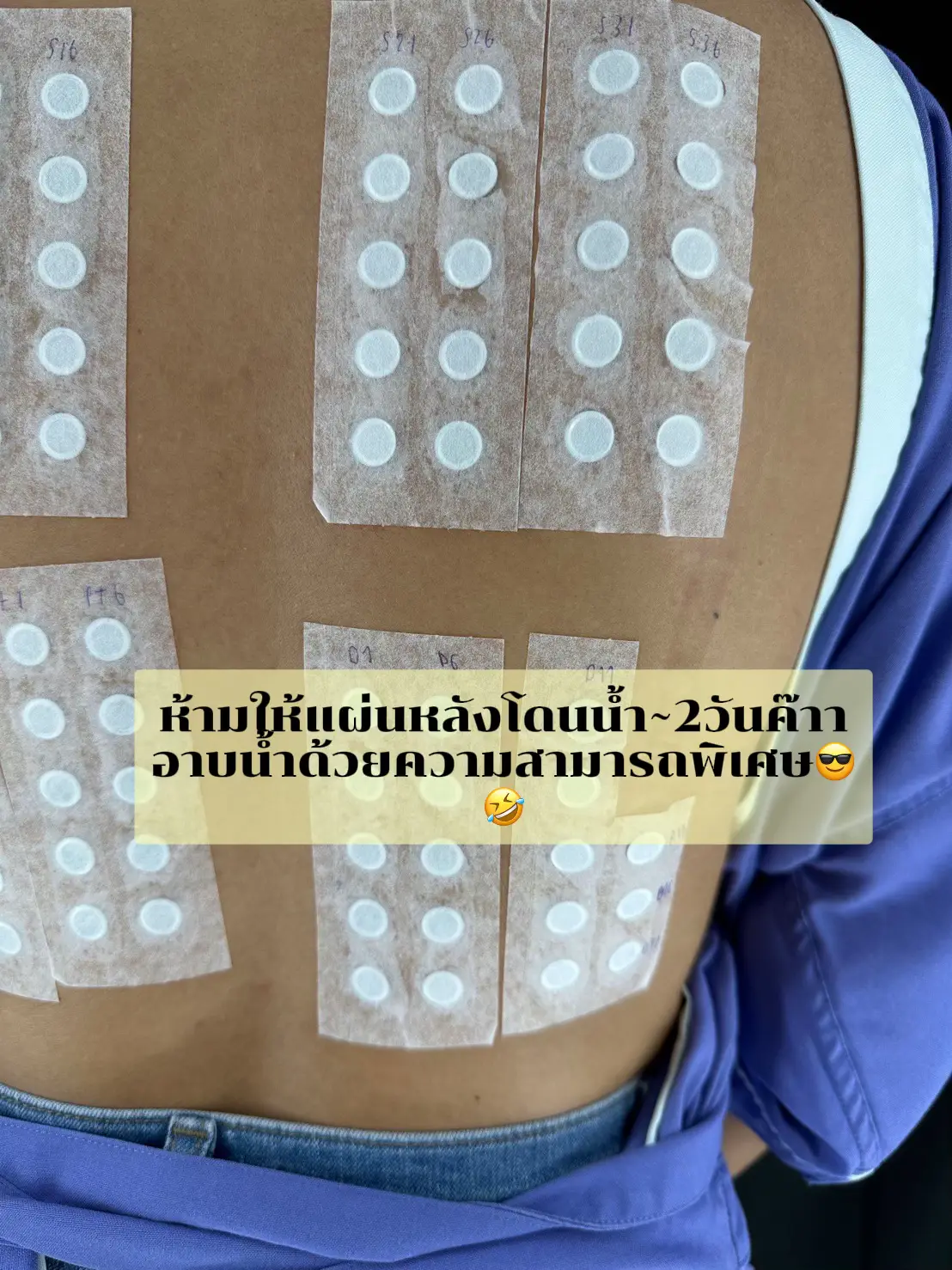 Patch test กับคนแพ้ลิปสติกแบบเรา | แกลเลอรีที่โพสต์โดย แอปปาเลิ่น | Lemon8