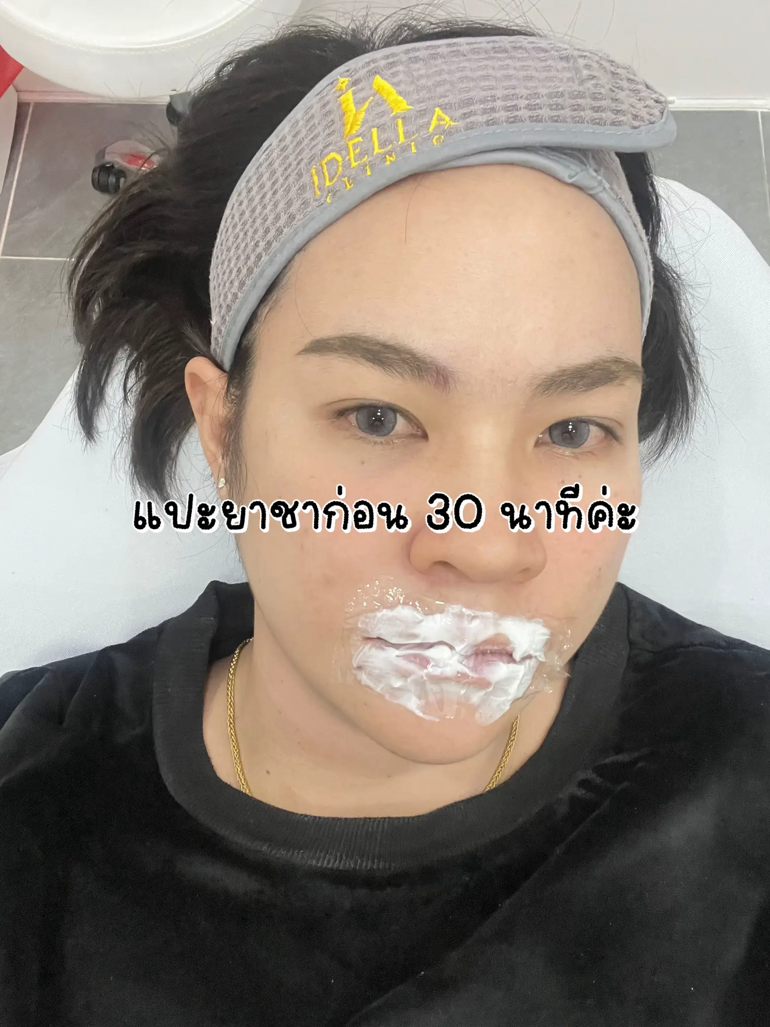 มือใหม่ฉีดฟิลเลอร์ครั้งแรก ขอ1 ซีซีก่อนค่ะหมอ | แกลเลอรีที่โพสต์โดย Ma riam | Lemon8