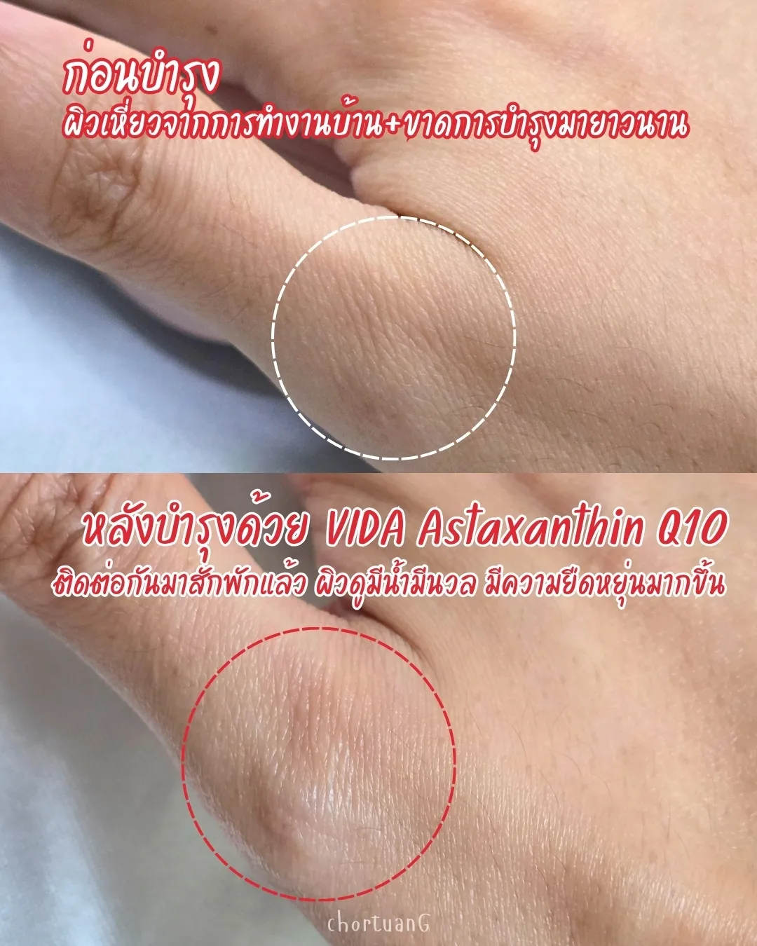 รีวิวมัดรวมวิตามินต้านแก่ ในวัย 35+ | แกลเลอรีที่โพสต์โดย Tarn Around ...