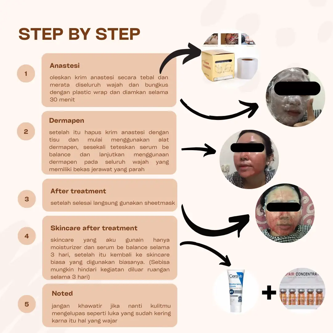 Menghilangkan Bekas Jerawat Paling Ampuh! | Galeri diposting oleh LentoMini | Lemon8
