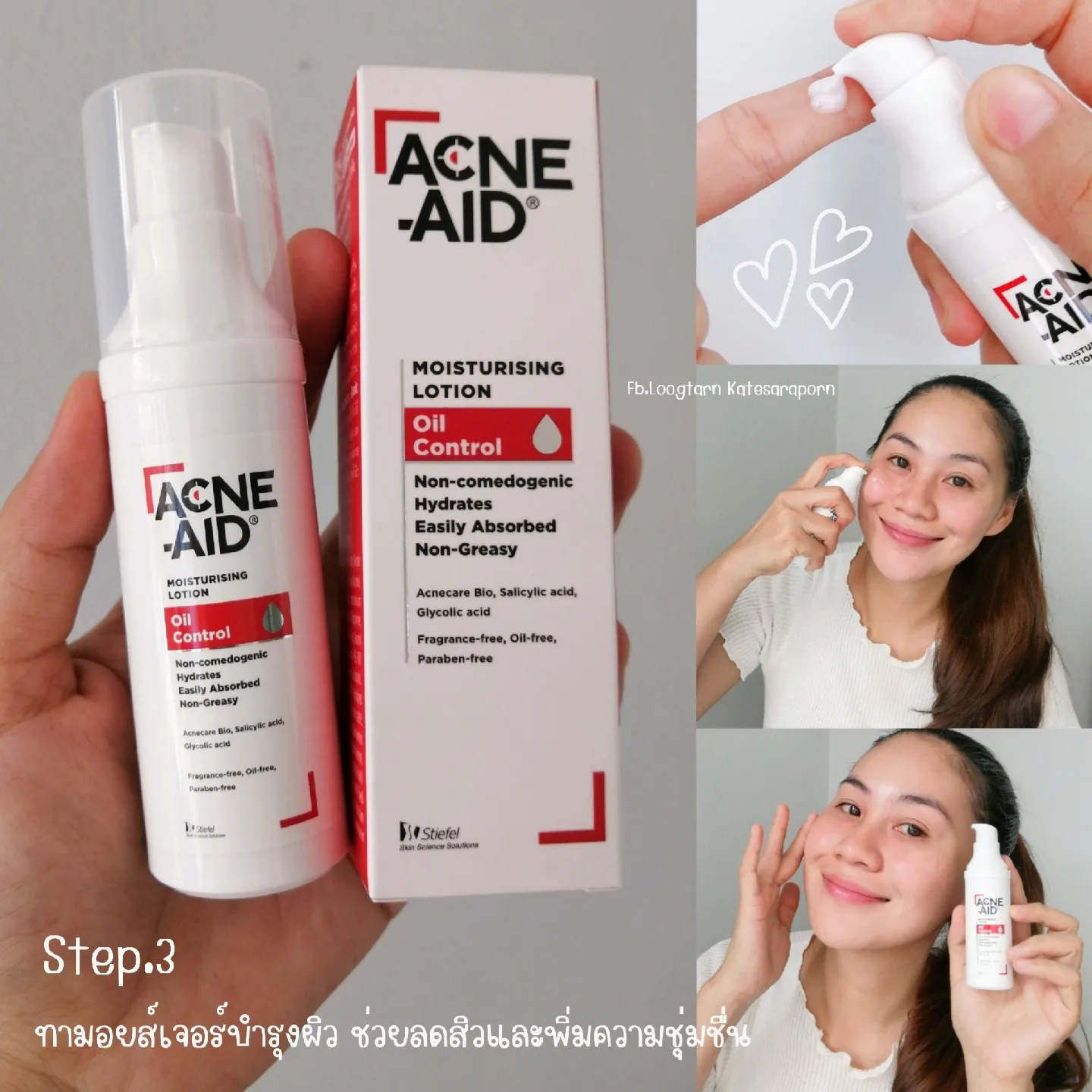 5 Step ดูแลผิวแพ้ง่าย กับ Acne-Aid | แกลเลอรีที่โพสต์โดย Loogtan02 | Lemon8