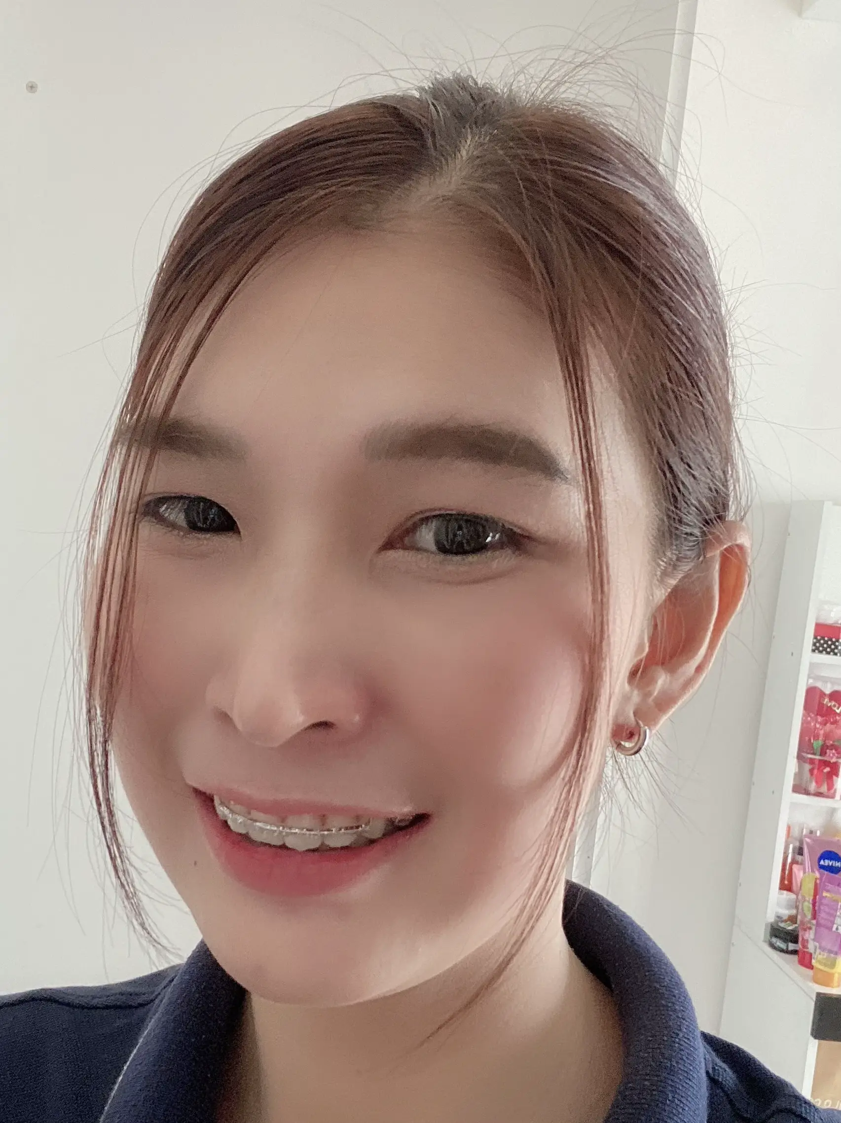 รีเทนเนอร์อันใหม่ (ชิ้นล่ะ 2,499) | แกลเลอรีที่โพสต์โดย Kratae Eight8 | Lemon8