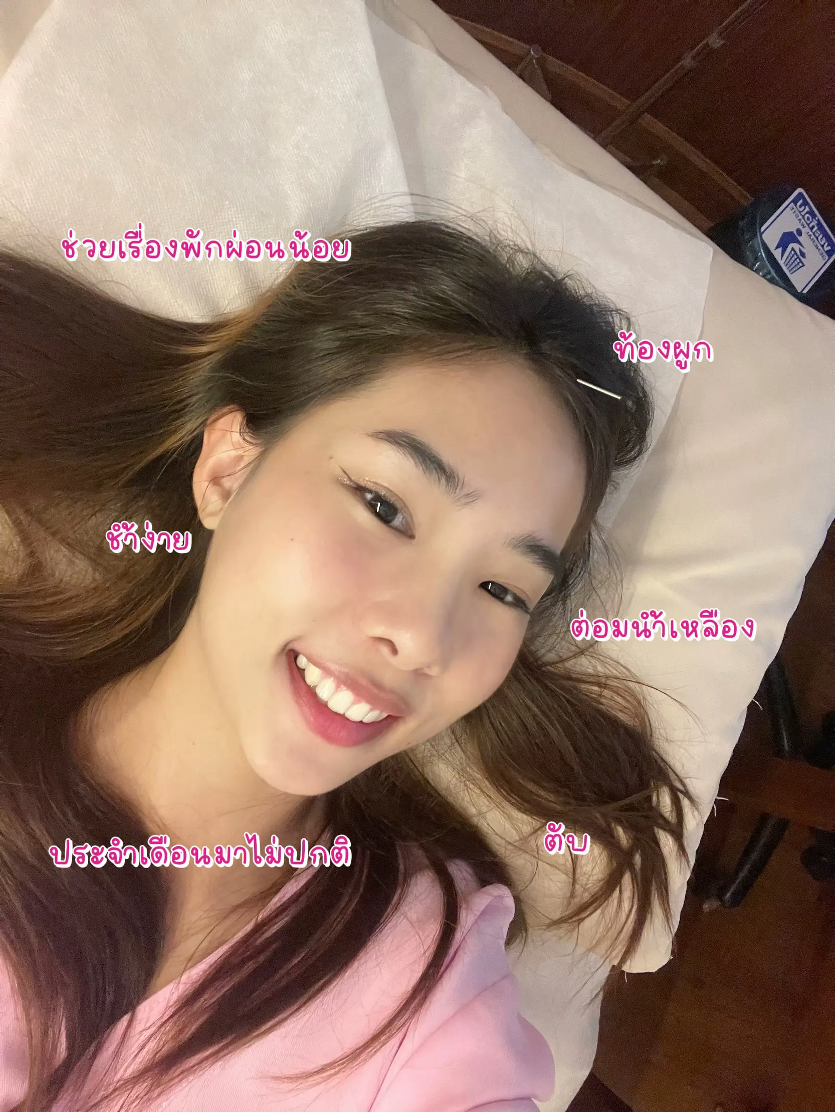 รีวิวฝังเข็มครั้งแรก🌟😻🌷 | แกลเลอรีที่โพสต์โดย Ammy | Lemon8