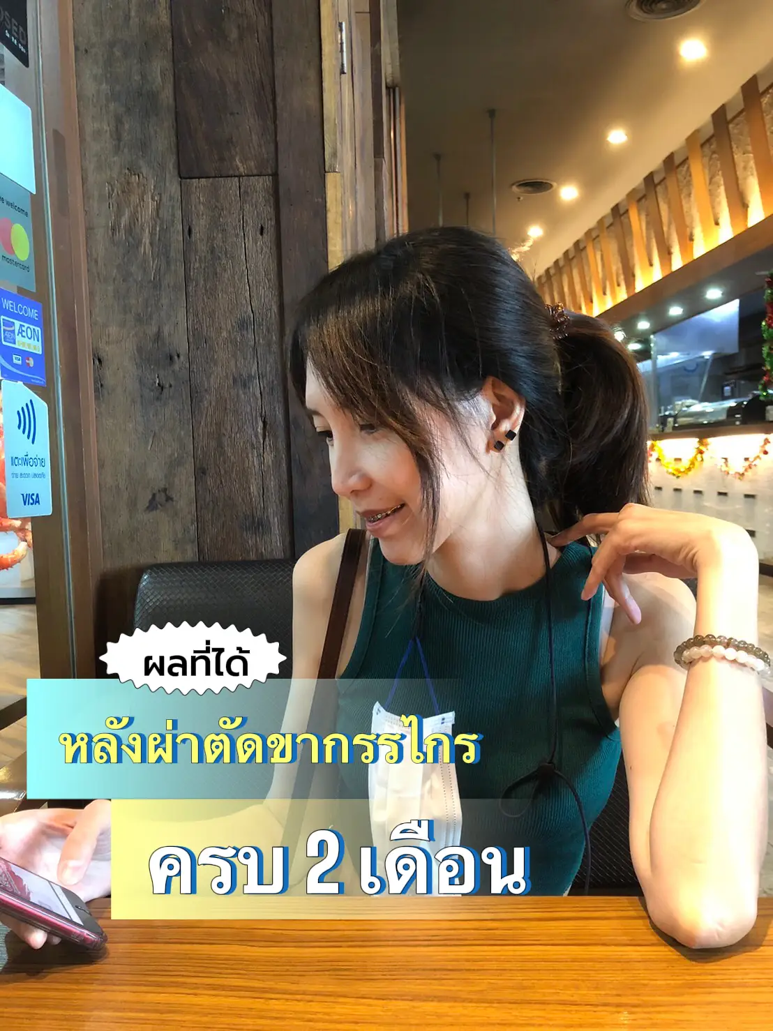 Ep.3、顎の手術2ヶ月。どれどれ。 | PpSAmEが投稿したフォトブック | Lemon8