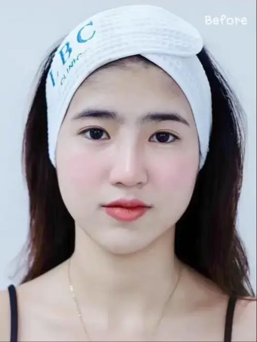 หน้าเรียวแบบลูกสาว LBC ด้วยโปร Size 3XL 👯‍♀️💙 | แกลเลอรีที่โพสต์โดย Lbc Beauty Club | Lemon8