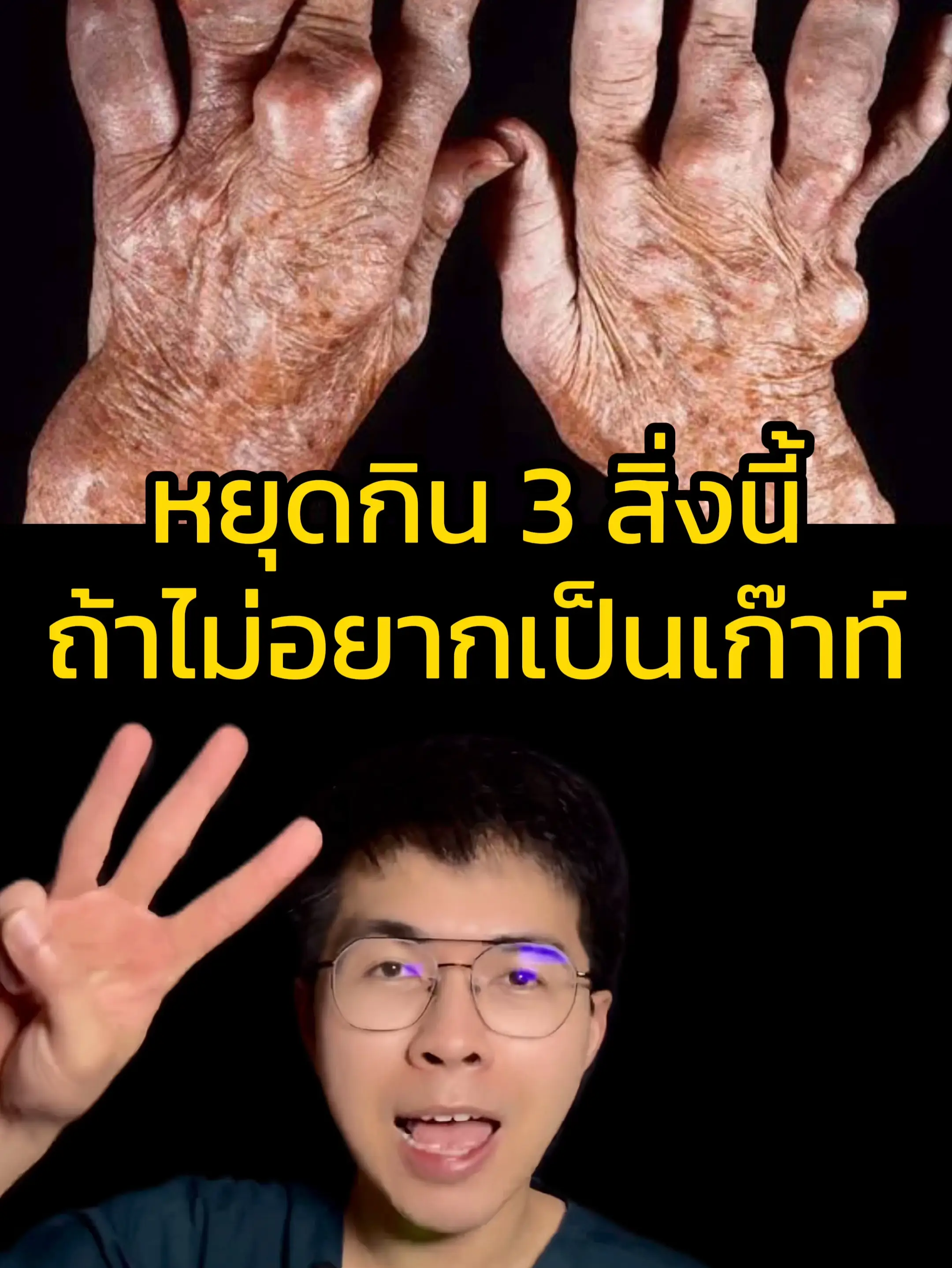 🛑หยุดทาน หากเป็นเก๊าท์‼️ | วิดีโอที่เผยแพร่โดย Dr.Pop | Lemon8