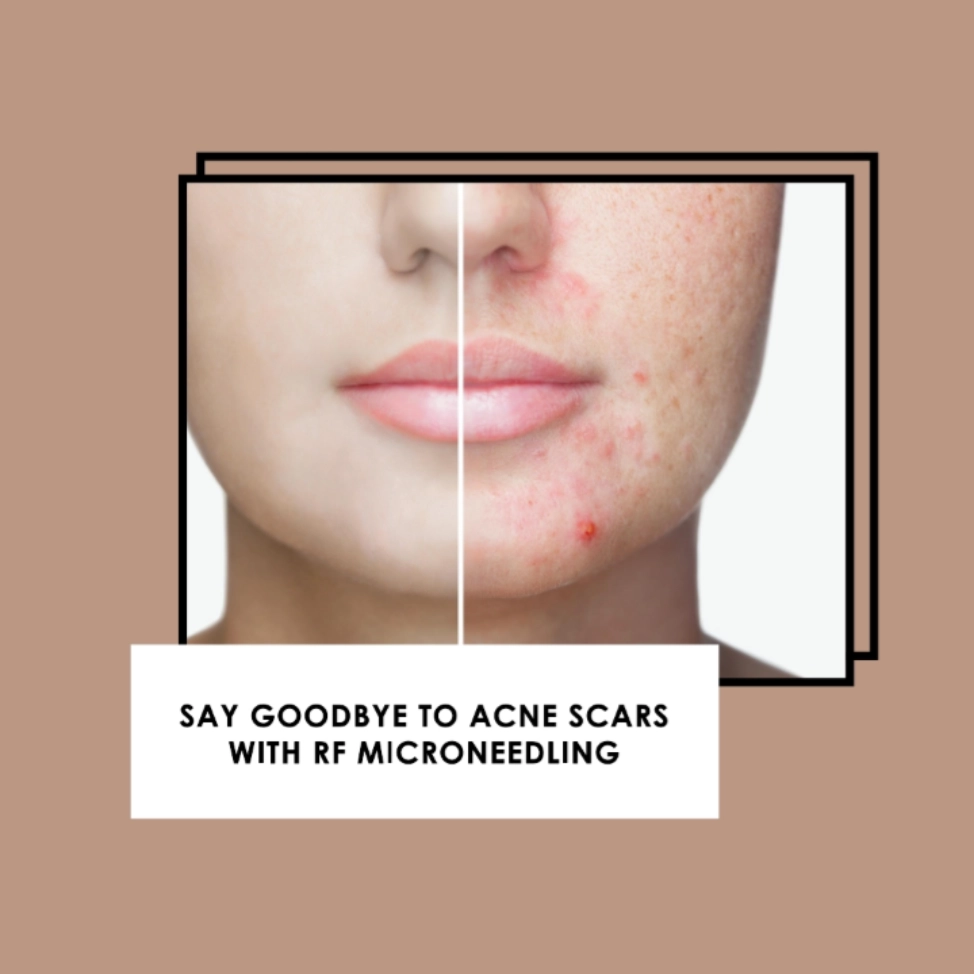 Effective Change: Transform Your Skin Today | Video published by George ...