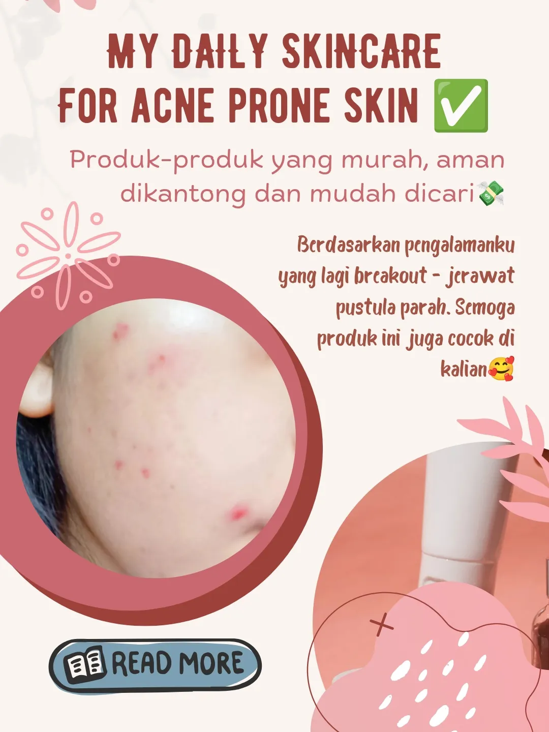 AMPUH BANGET HEMPASKAN JERAWAT & RAMAH DIKANTONG💸 | Galeri diposting ...