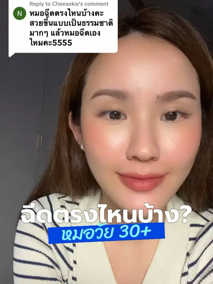 วัย 30+ เติมฟิลเลอร์ตรงไหนมาบ้าง | วิดีโอที่เผยแพร่โดย Thewika T. | Lemon8