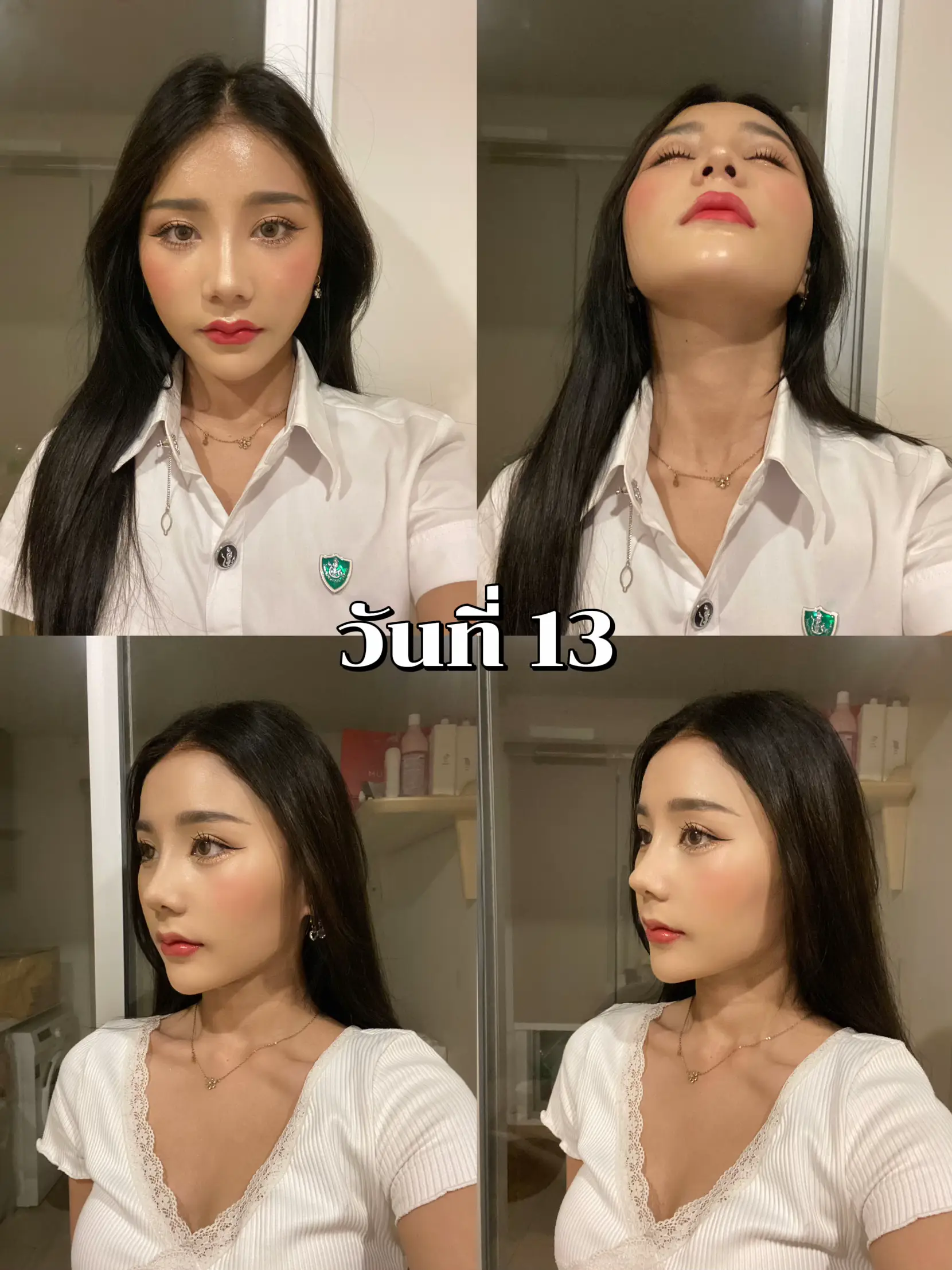 ศัลยกรรมครั้งแรกในชีวิต ปังหรือพัง ‼️ | แกลเลอรีที่โพสต์โดย Nu Dee🐰 | Lemon8