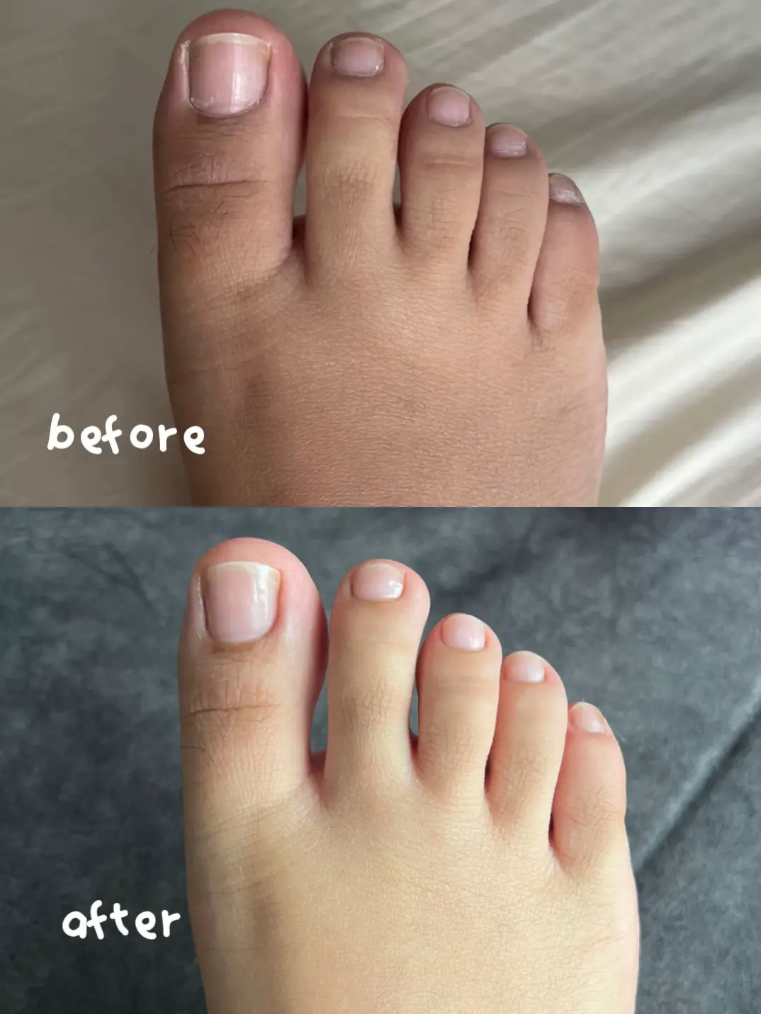 Simple Foot Care At Home🦶🏻Jimat & Mudah! | Galeri diposting oleh kween ...