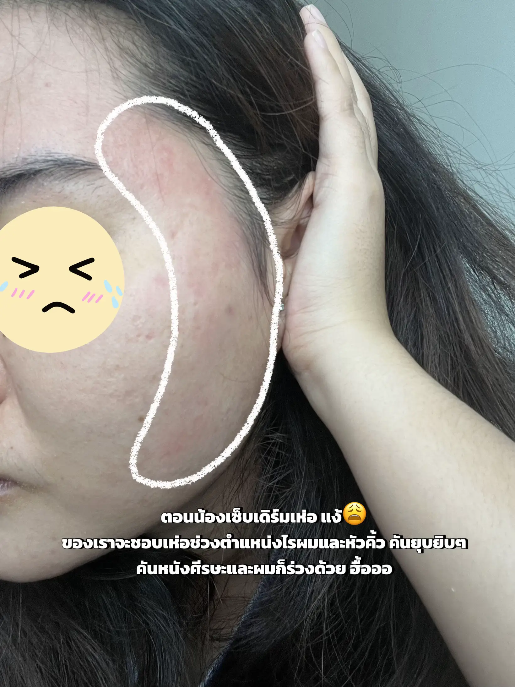 แชมพูตัวเด็ด แก้รังแค หนังหัวลอก เซ็บเดิร์ม คันหนังศีรษะ | แกลเลอรีที่โพสต์โดย I’am cy | Lemon8