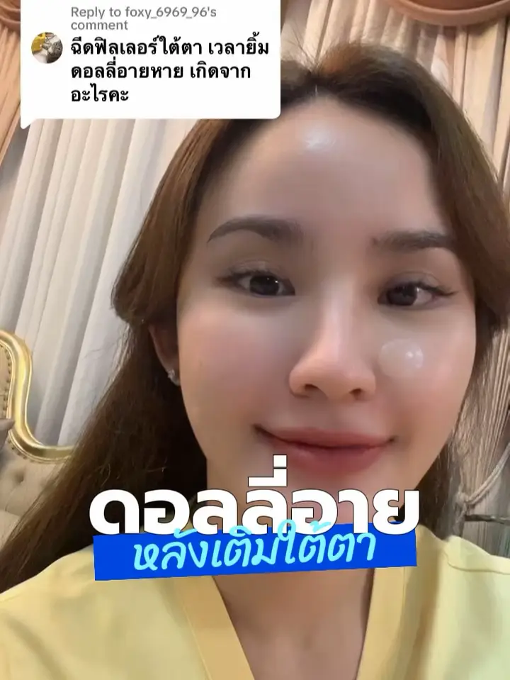 ดอลลี่อาย หาย! หลังเติมใต้ตา | วิดีโอที่เผยแพร่โดย Thewika T. | Lemon8