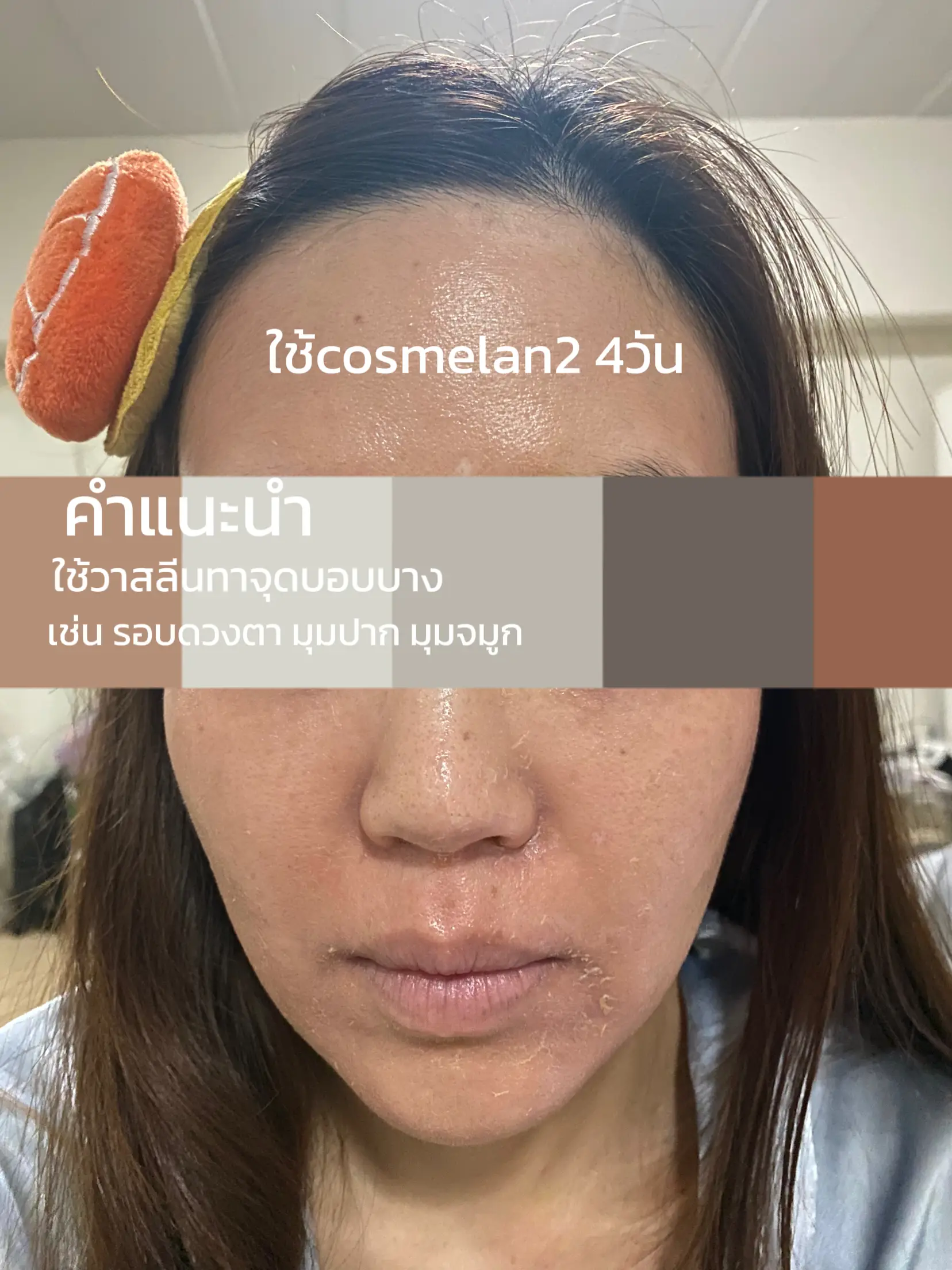 Review พลีชีพ ครีมรักษากระ cosmelan2 | แกลเลอรีที่โพสต์โดย Pupoo Prey | Lemon8