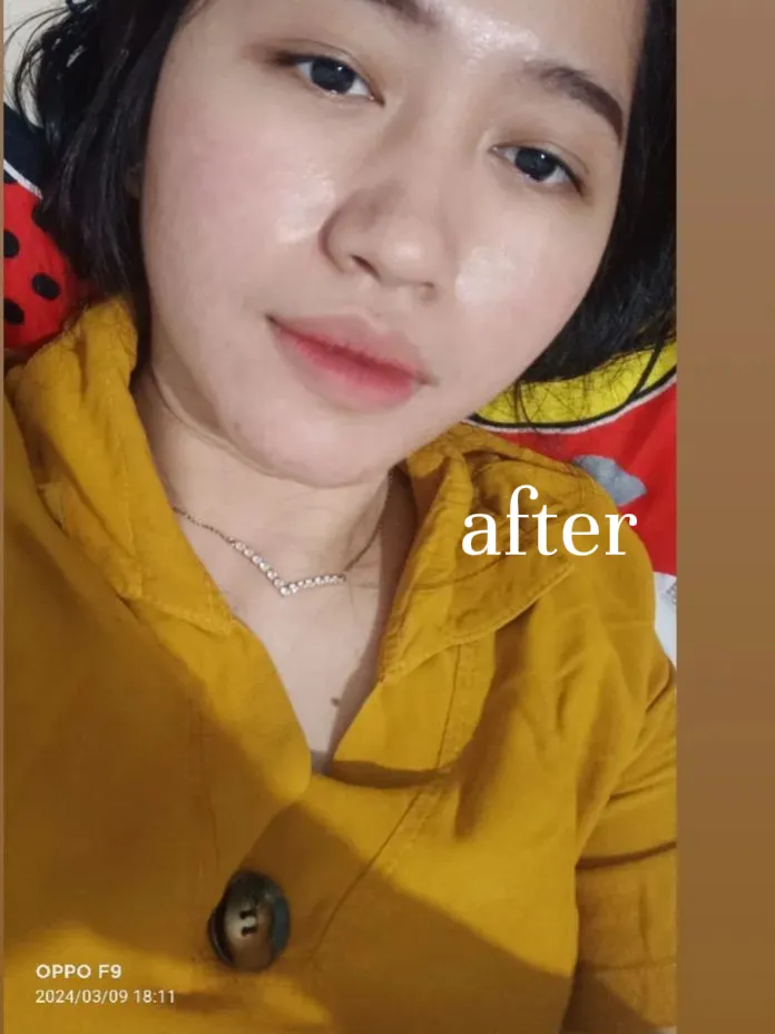 jerwatan 3tahunan,1buln Konsul halodoc ada perubah | Galeri diposting oleh Miftah | Lemon8