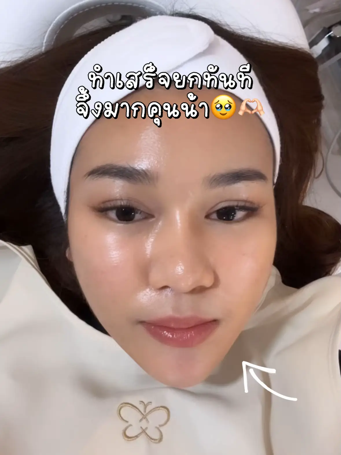 😍หัตถการที่เลือกทำในวัย 26 ทำไมสวยกว่าตอน 24 | แกลเลอรีที่โพสต์โดย Panglpp | Lemon8