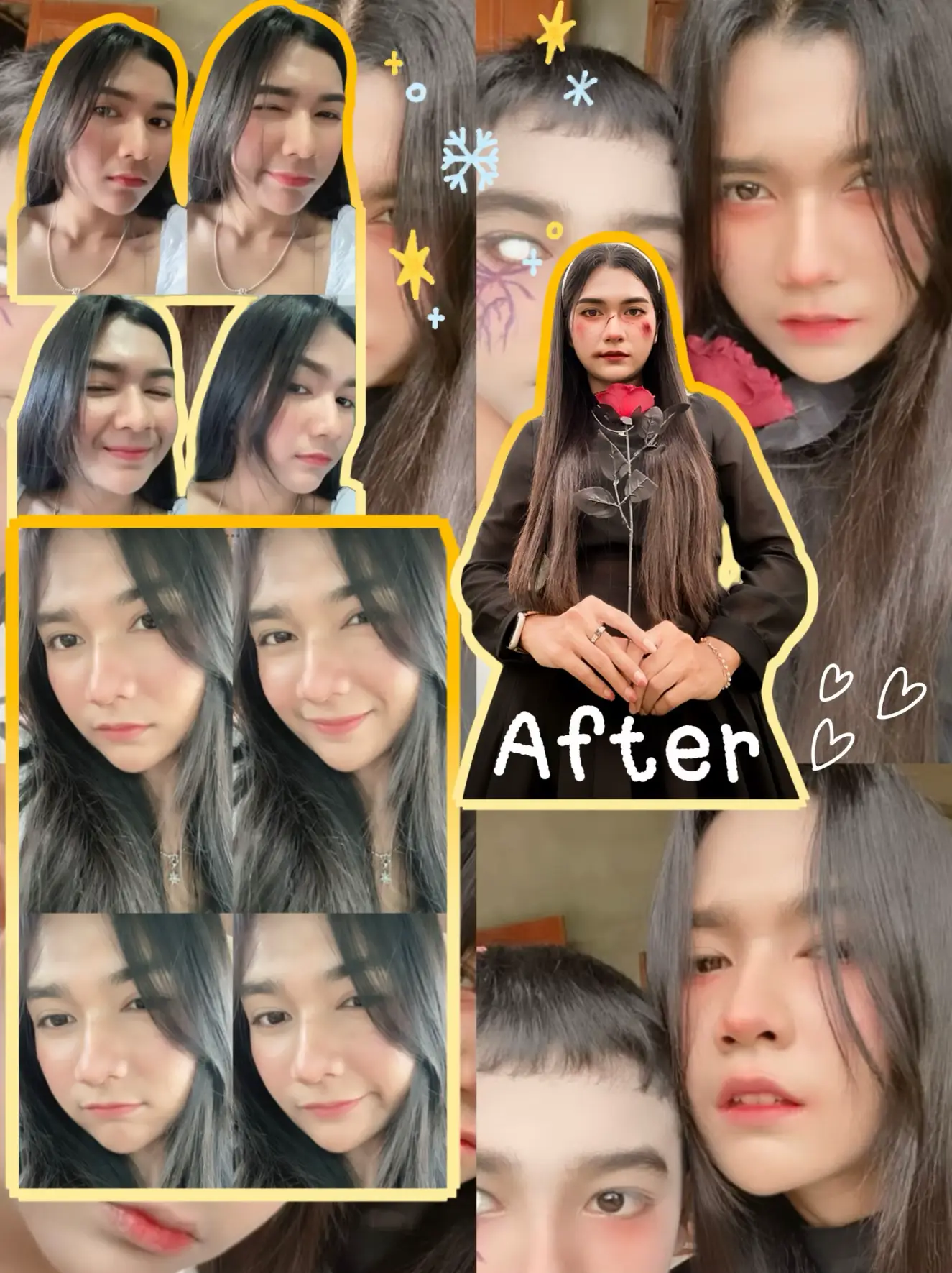 กังนัมคลินิก ฟิลเลอร์ 1999 - การค้นหาใน Lemon8