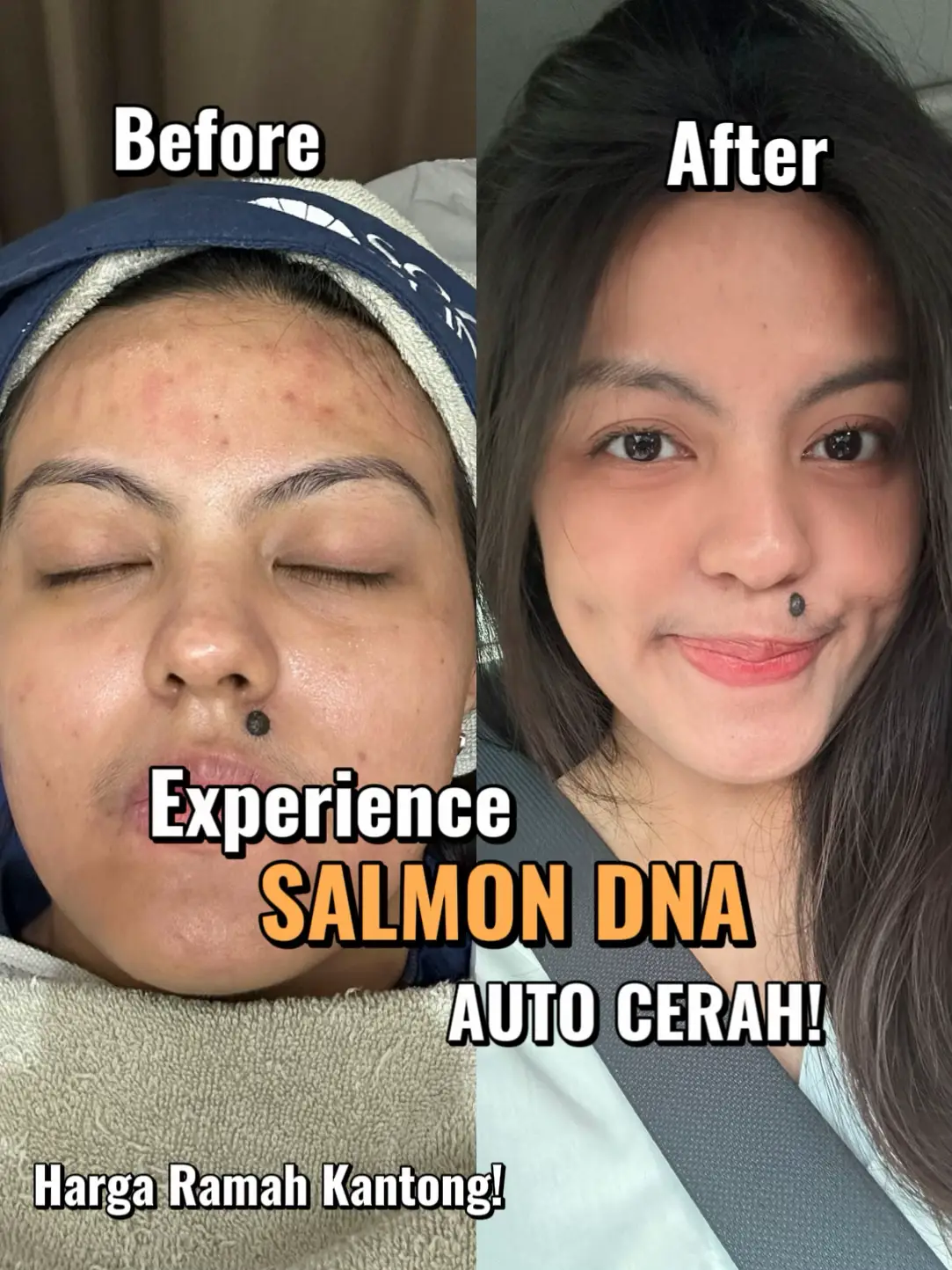 EXPERIENCE SALMON DNA! 🌞 | Galeri diposting oleh Shera Regina | Lemon8