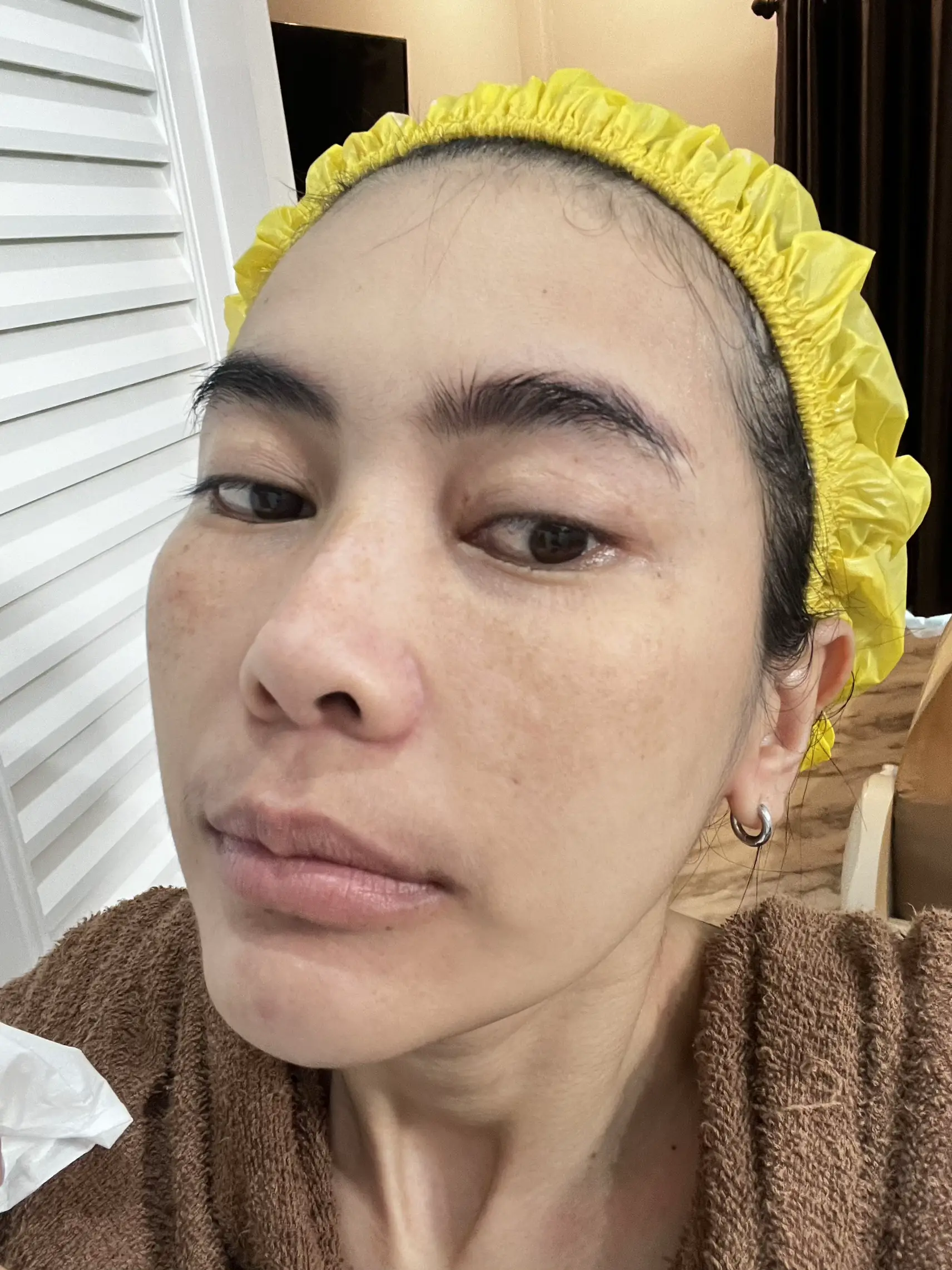 ทดลองใช้ครบ1เดือน สู้กับฝ้า🥺 | แกลเลอรีที่โพสต์โดย 𝗠𝗨𝗞 | Lemon8